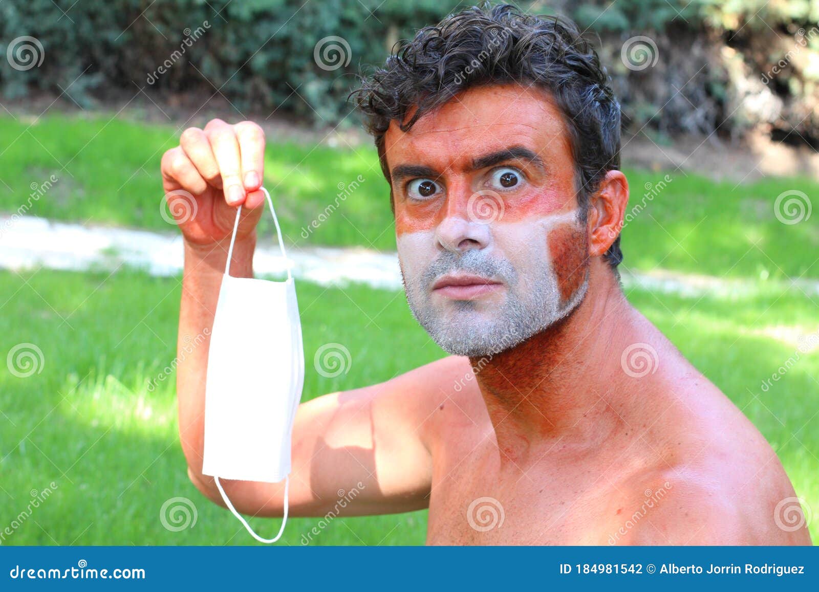 Man Getting Sunburnt during Summer 2020 Stock Photo - Image of ...