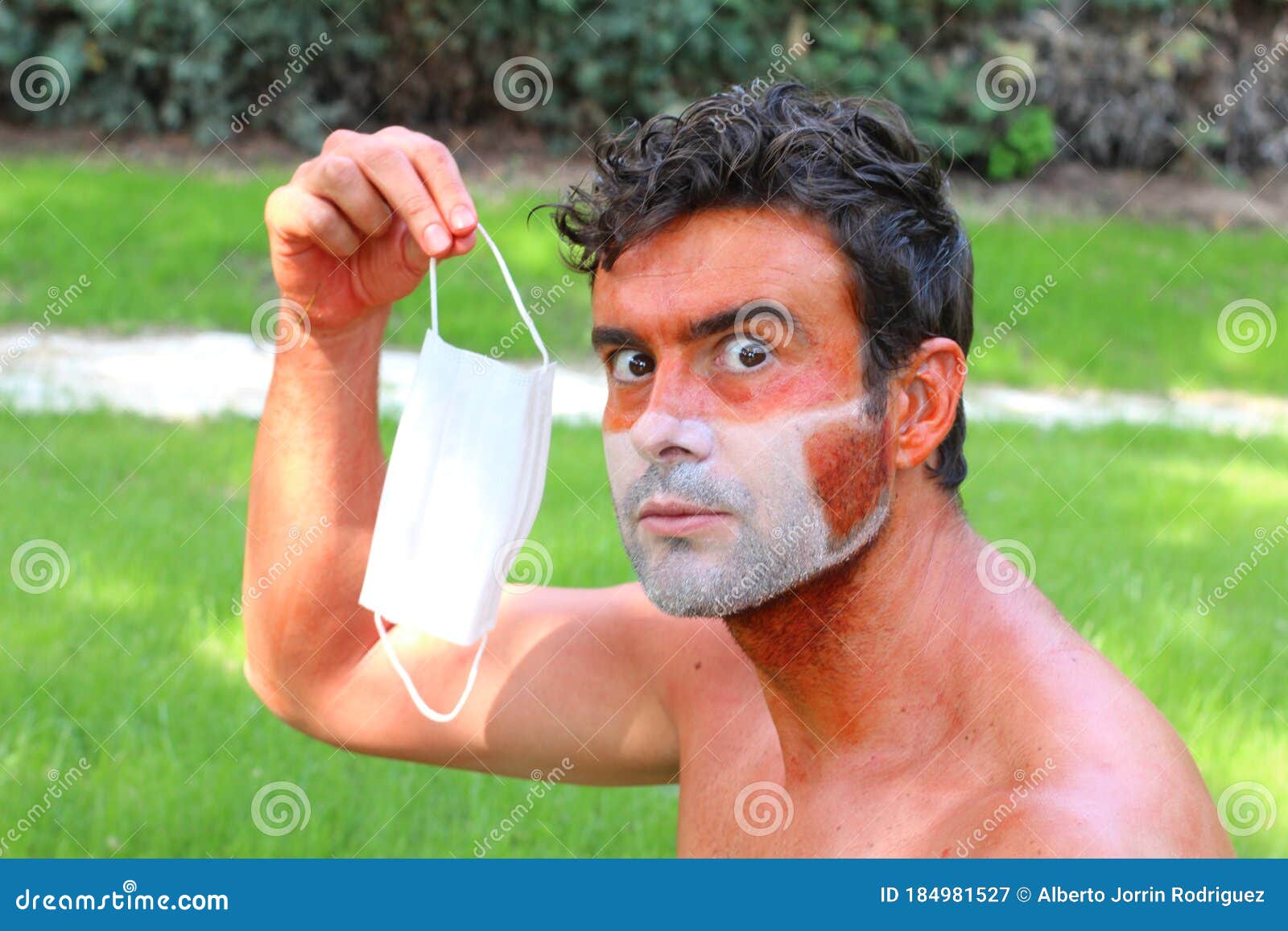 Man Getting Sunburnt during Summer 2020 Stock Image - Image of measures ...