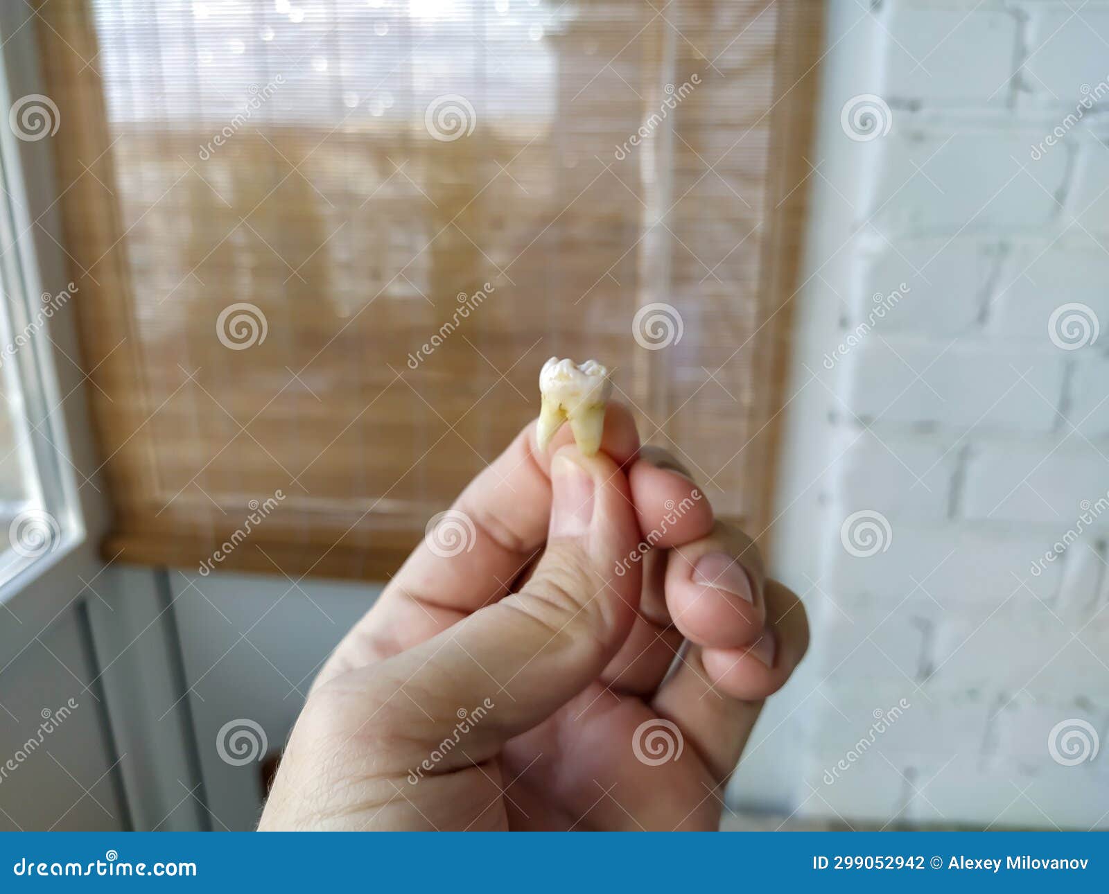 Man Hand Holds an Extracted Tooth Stock Photo - Image of medical ...