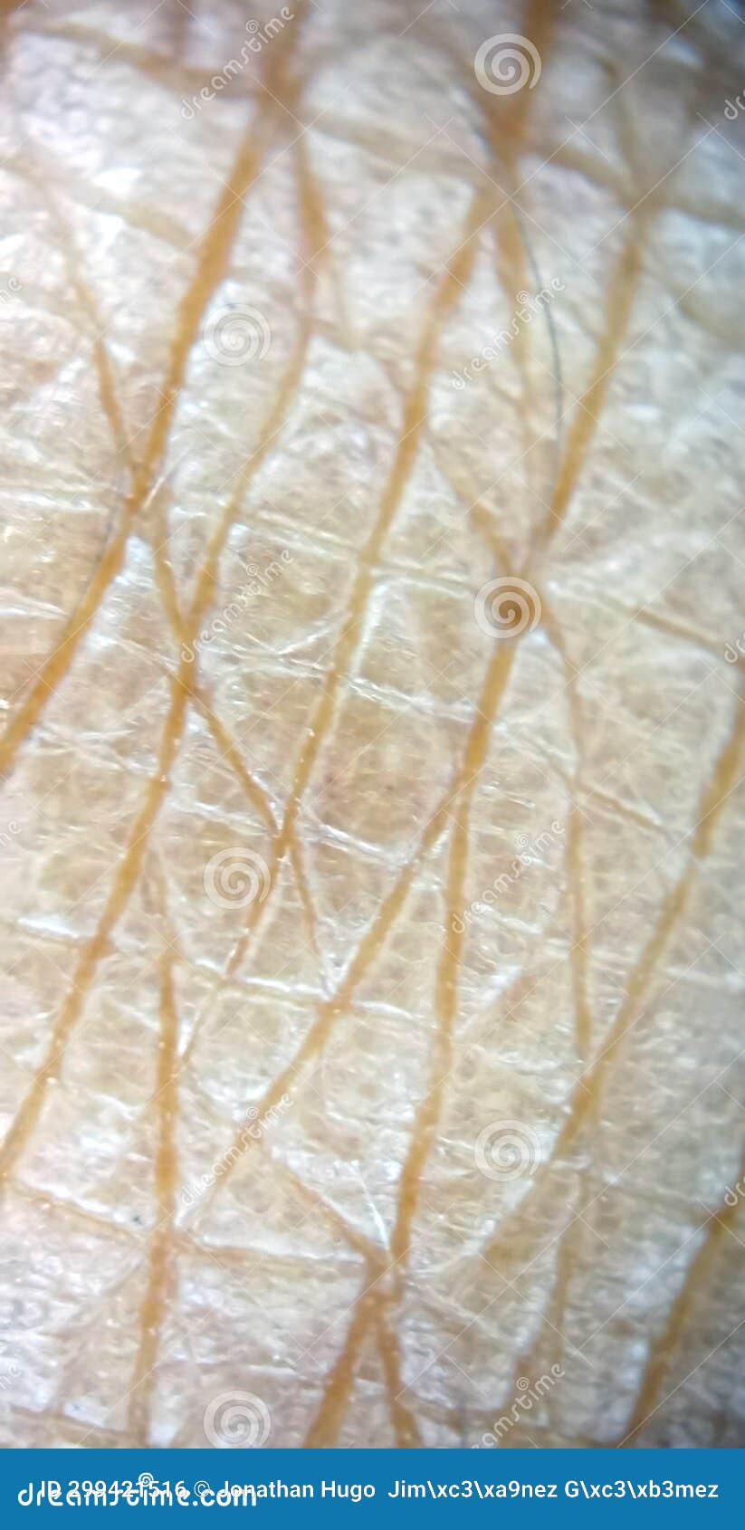 Man Hand Skin View at the Microscope Texture Stock Photo - Image of ...