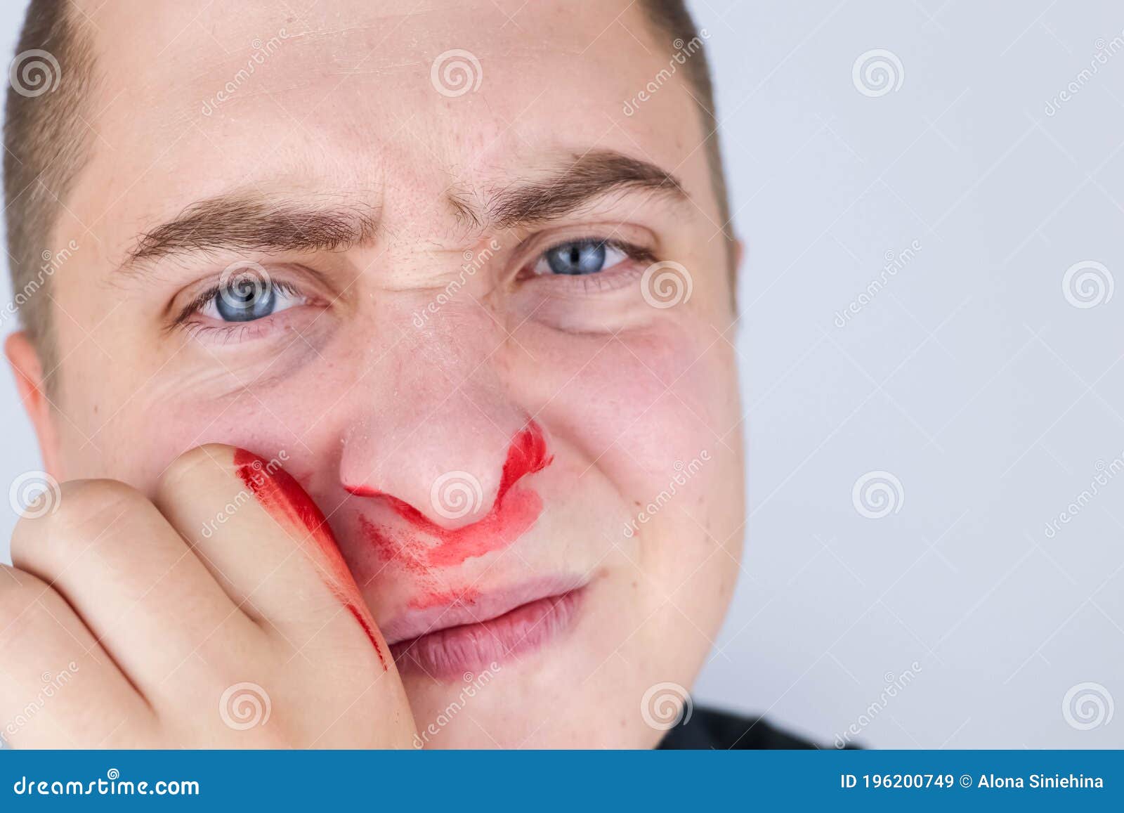 The Man Has a Broken Nose after a Fight. Blood on Hands, Cheeks and ...