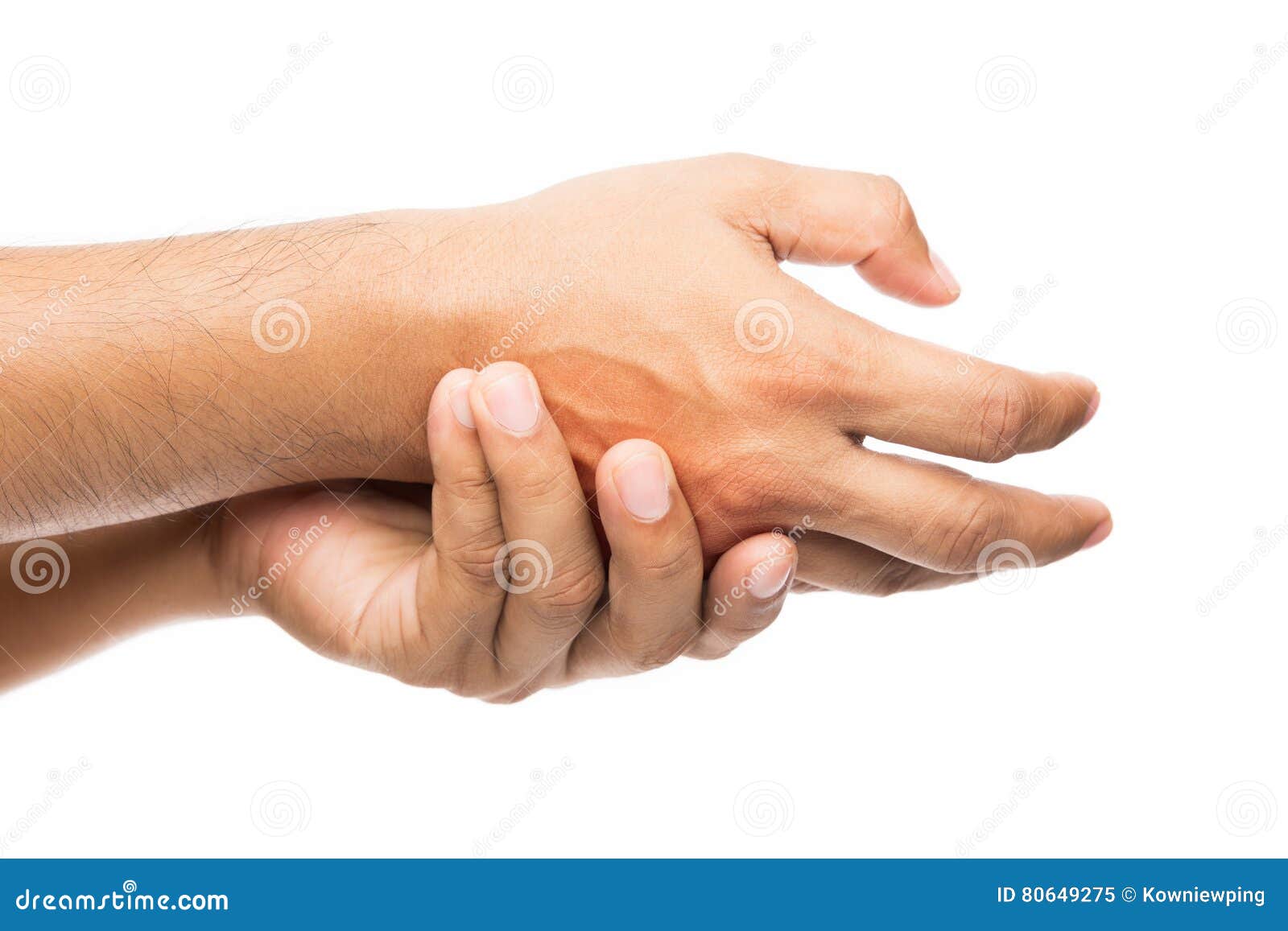 Man has pain in hand stock image. Image of people, inflame - 80649275
