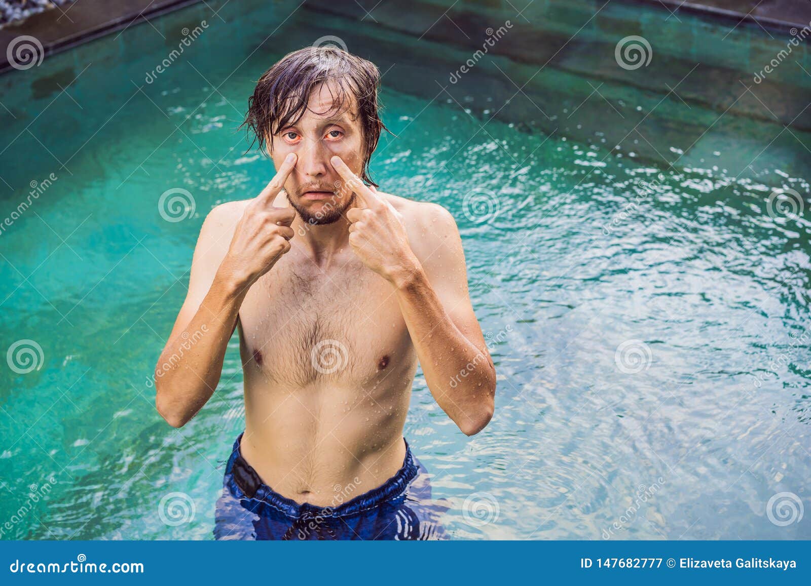 The Man Has Red Eyes after the Pool Stock Image - Image of adorable ...