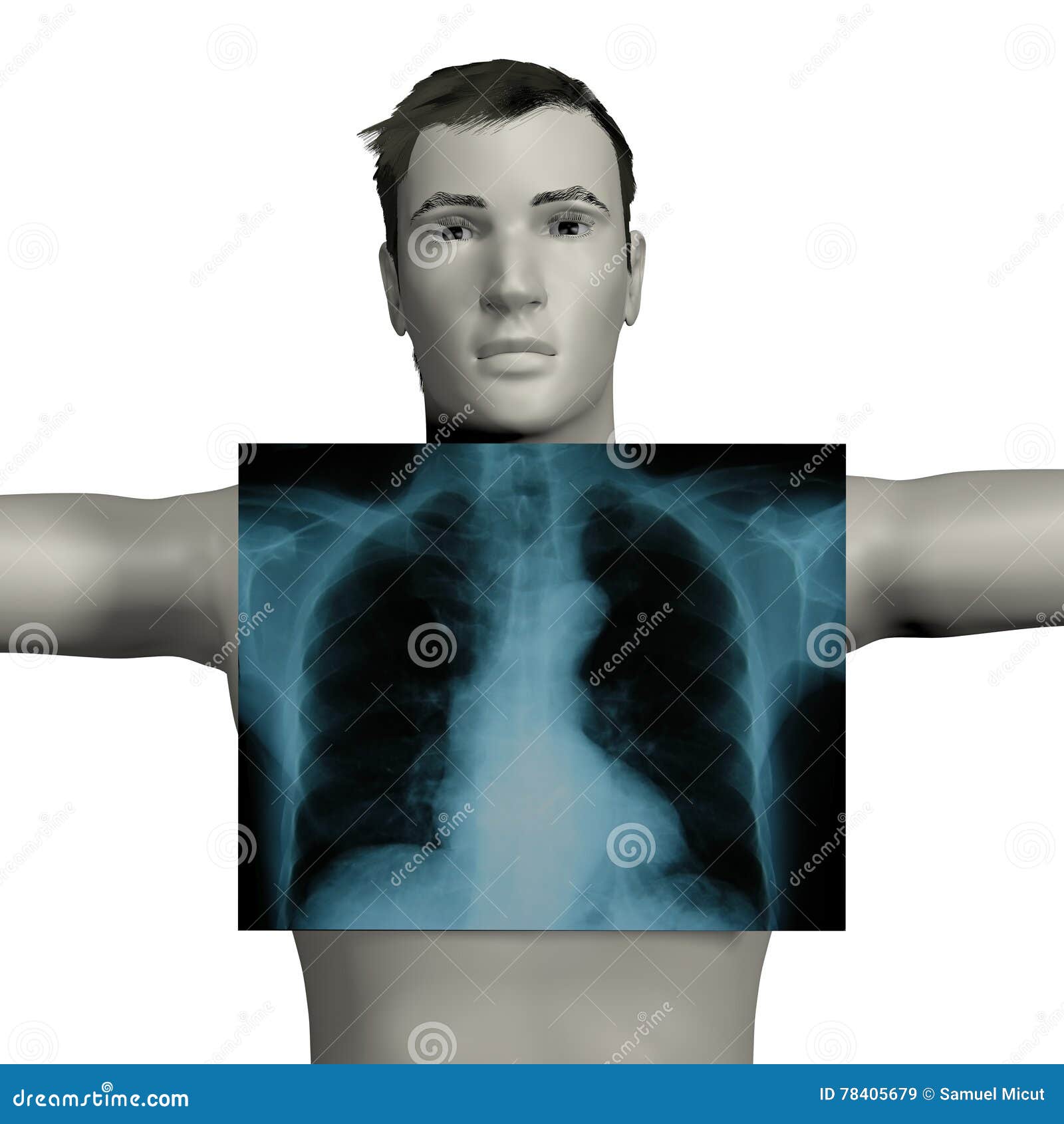 Man Having Chest Pain In The Upper And Middle Rib Cage, Cartilage ...