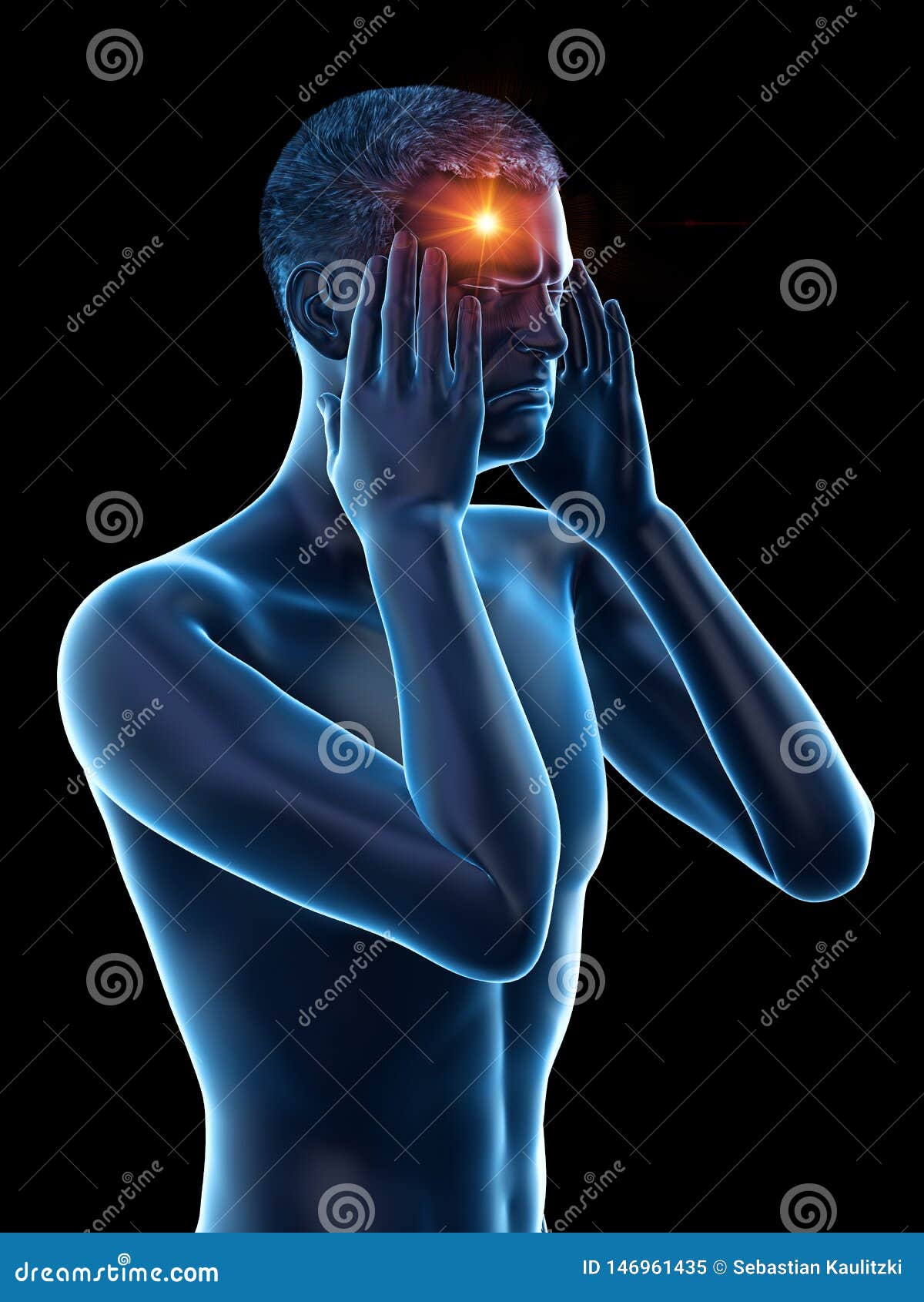 Cluster Headache Illustration