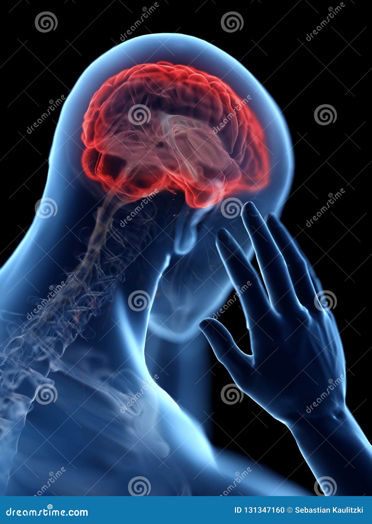 Set Man Having Headache, Psoriasis Or Eczema Rash, Microscope, Reddish ...