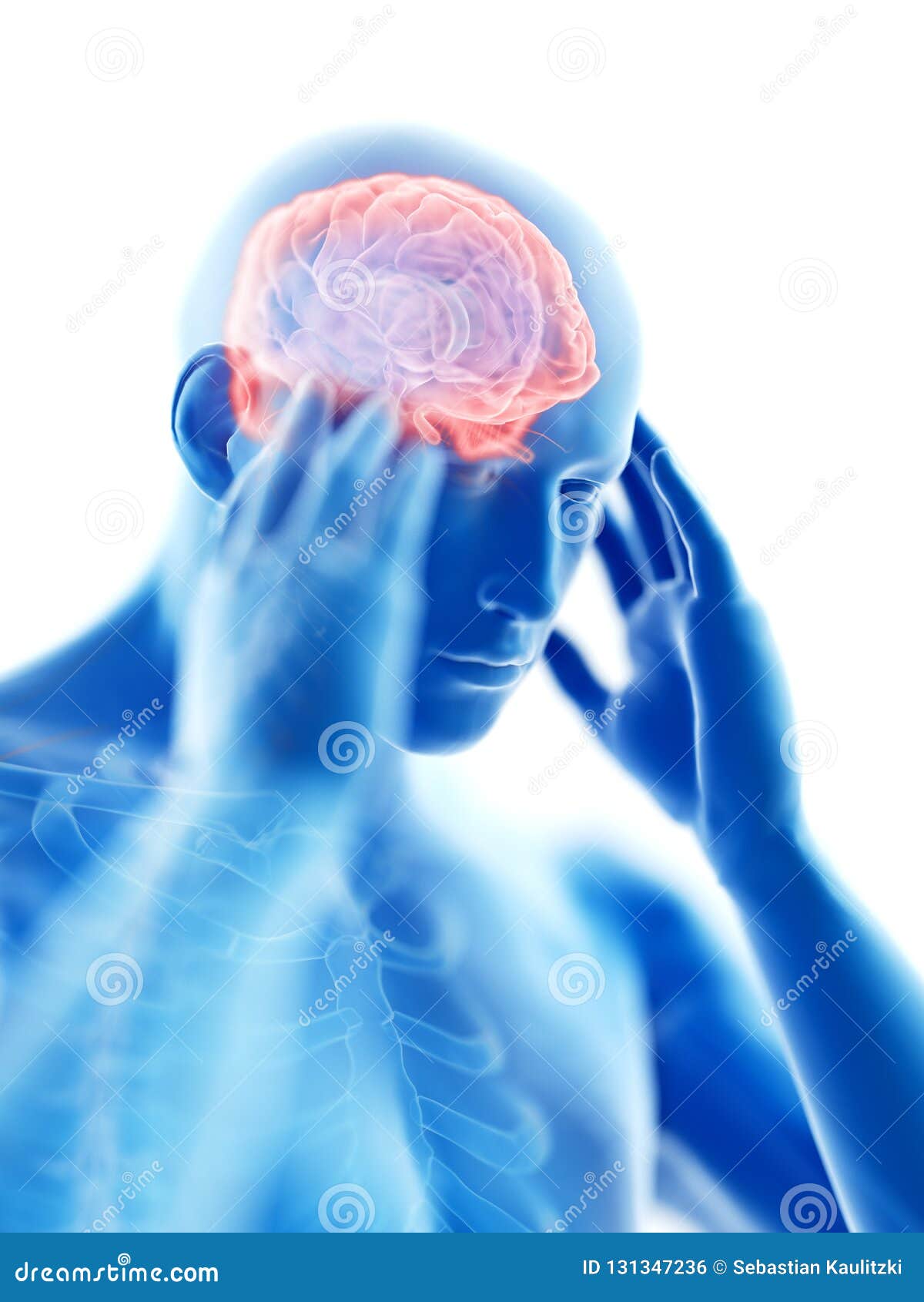 Set Man Having Headache, Psoriasis Or Eczema Rash, Microscope, Reddish ...