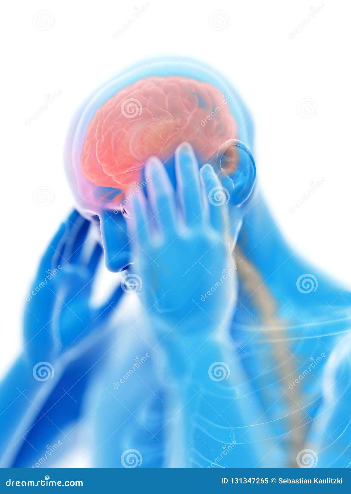 Set Man Having Headache, Psoriasis Or Eczema Rash, Microscope, Reddish ...