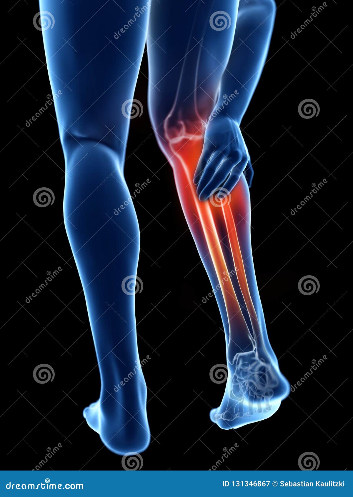 A Man Having a Painful Calf Stock Illustration - Illustration of ...