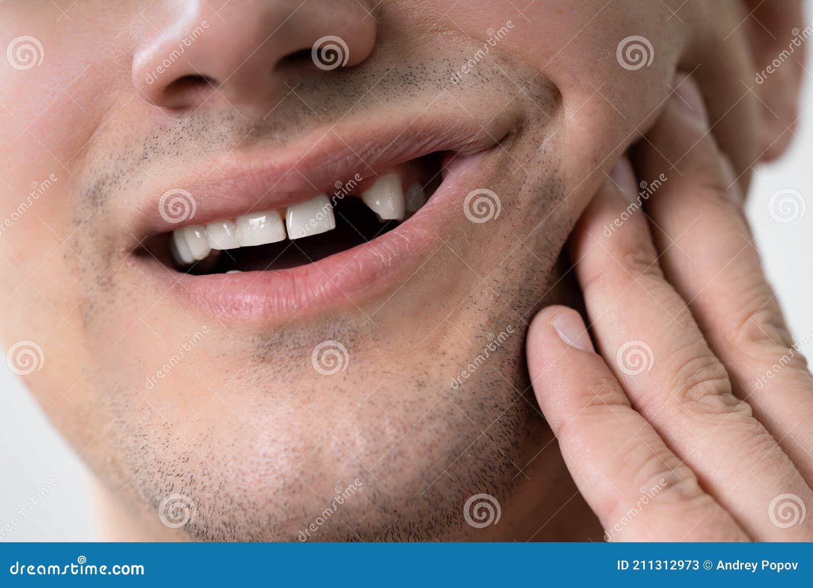 Man Having Toothache stock image. Image of lips, male - 211312973