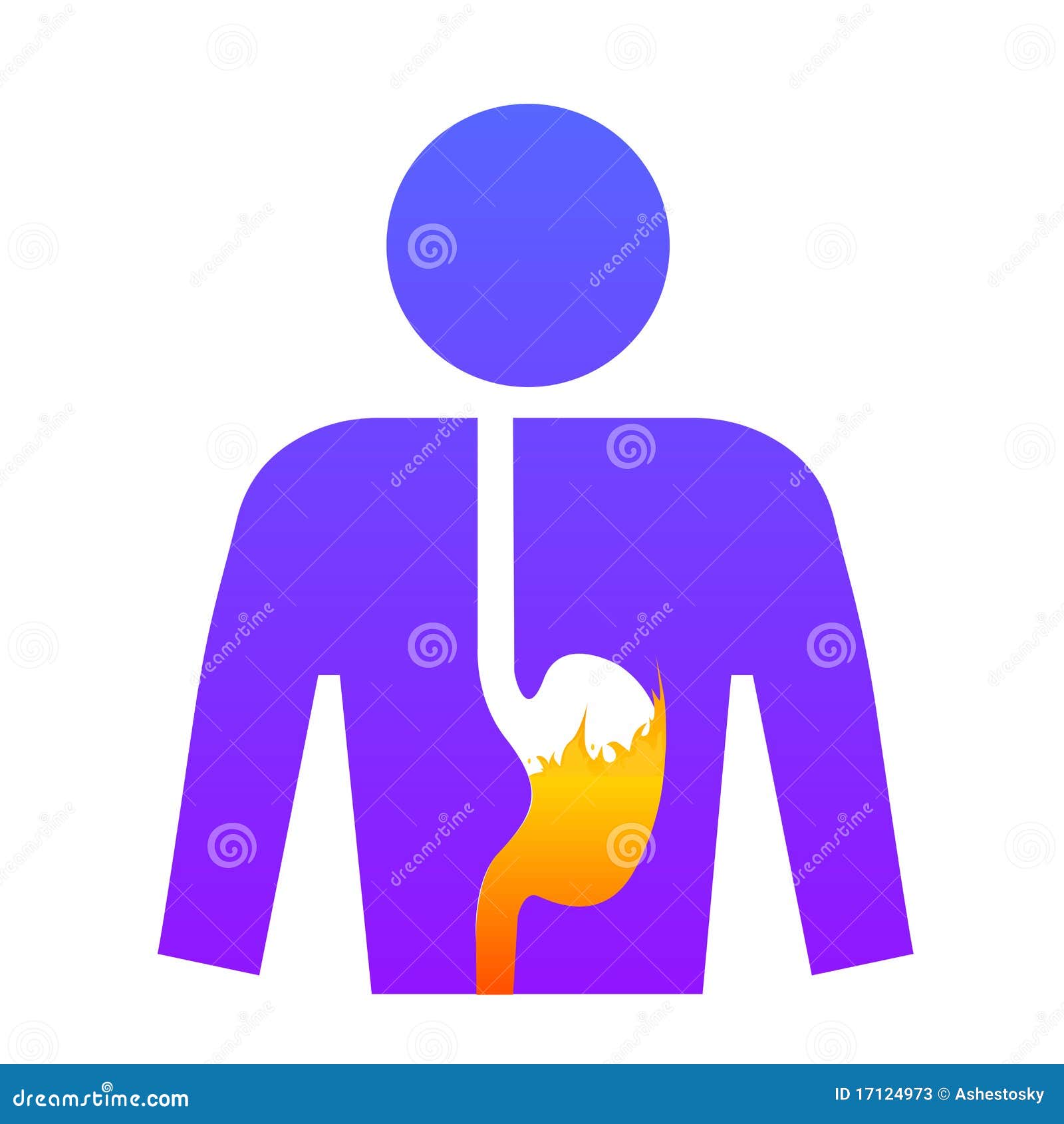 Person with Heartburn Stomach Stock Vector - Illustration of dyspepsia ...