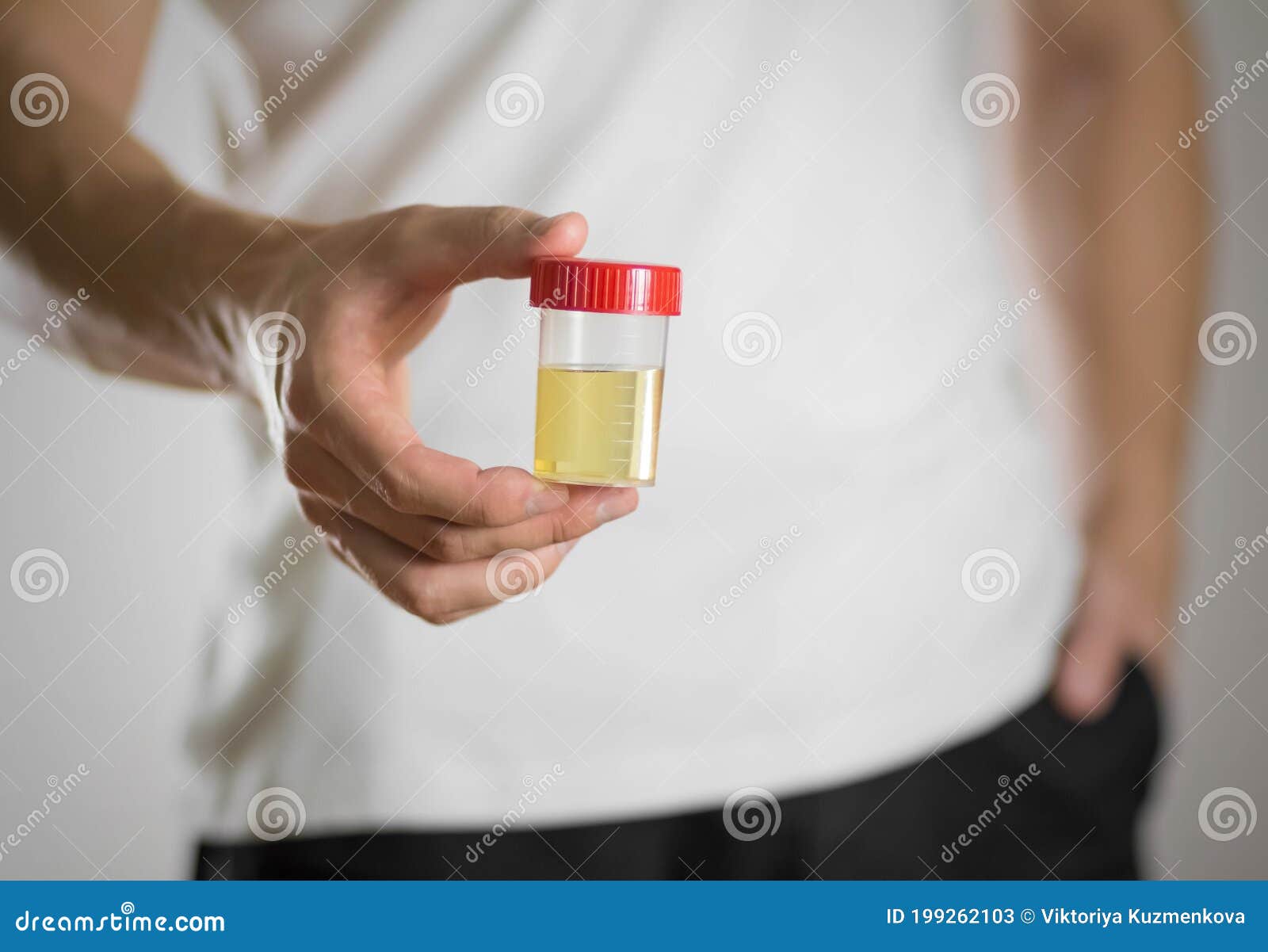 Urine Test For Candida Fungus On Laboratory Microscope Stock Photo ...