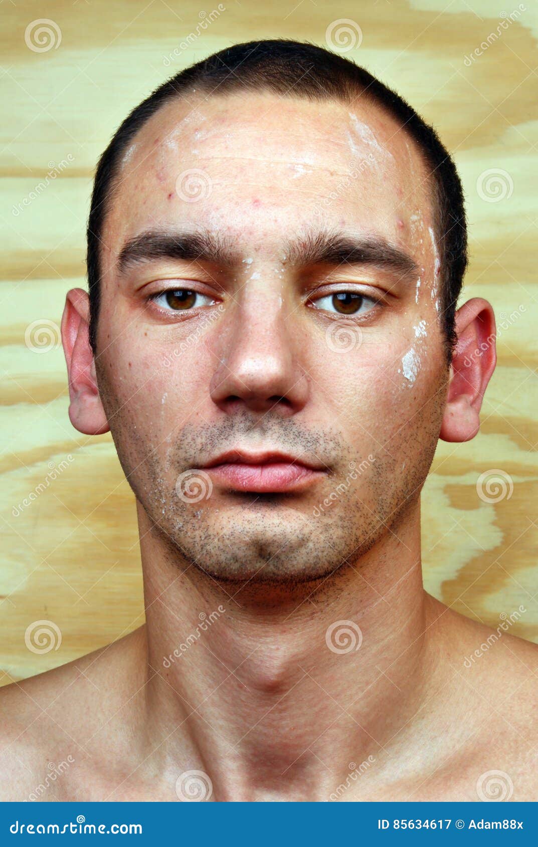 Man with Infected Skin on the Face Stock Image - Image of allergic ...
