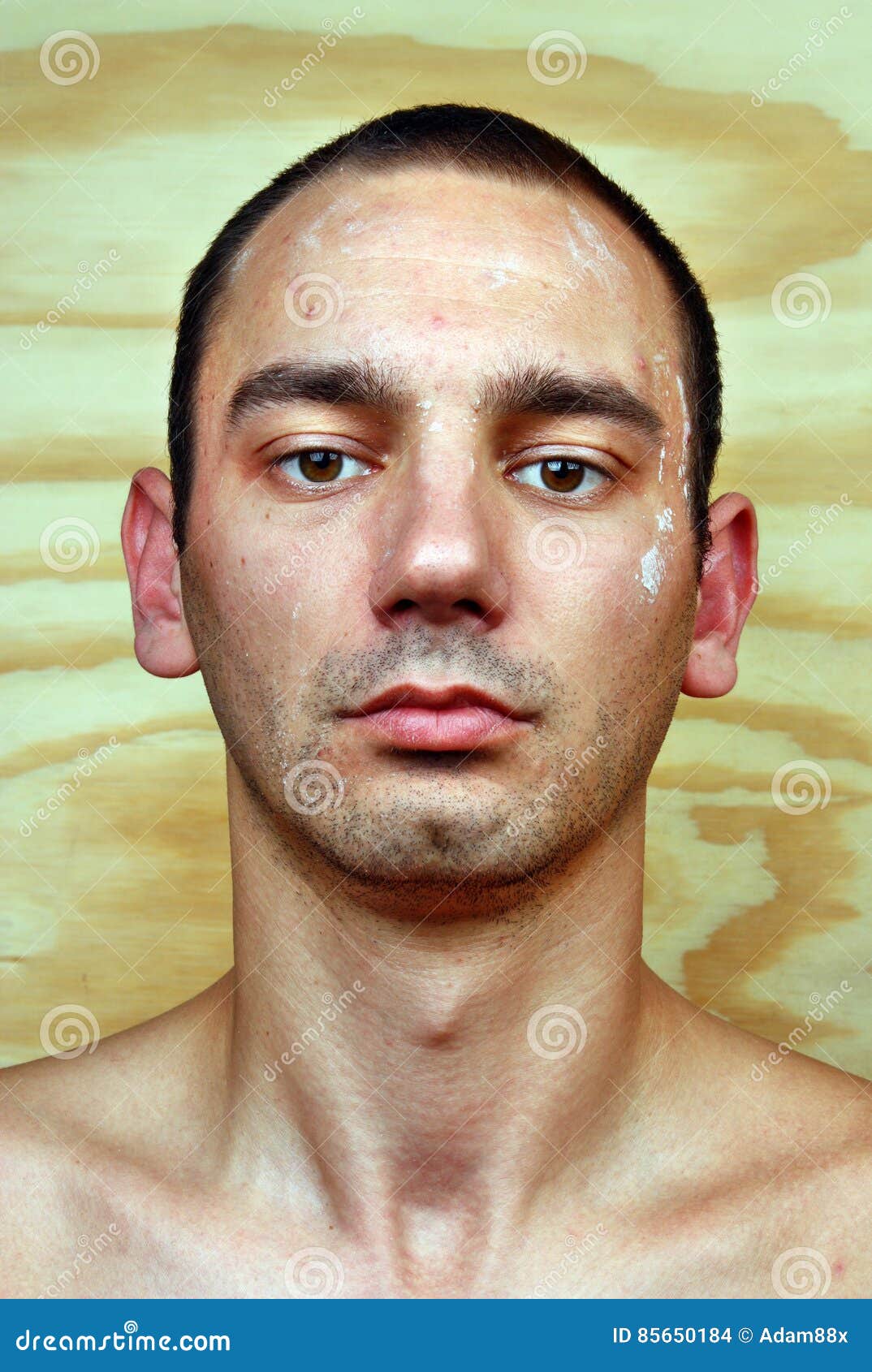 Man with Infected Skin on the Face Stock Photo - Image of face ...