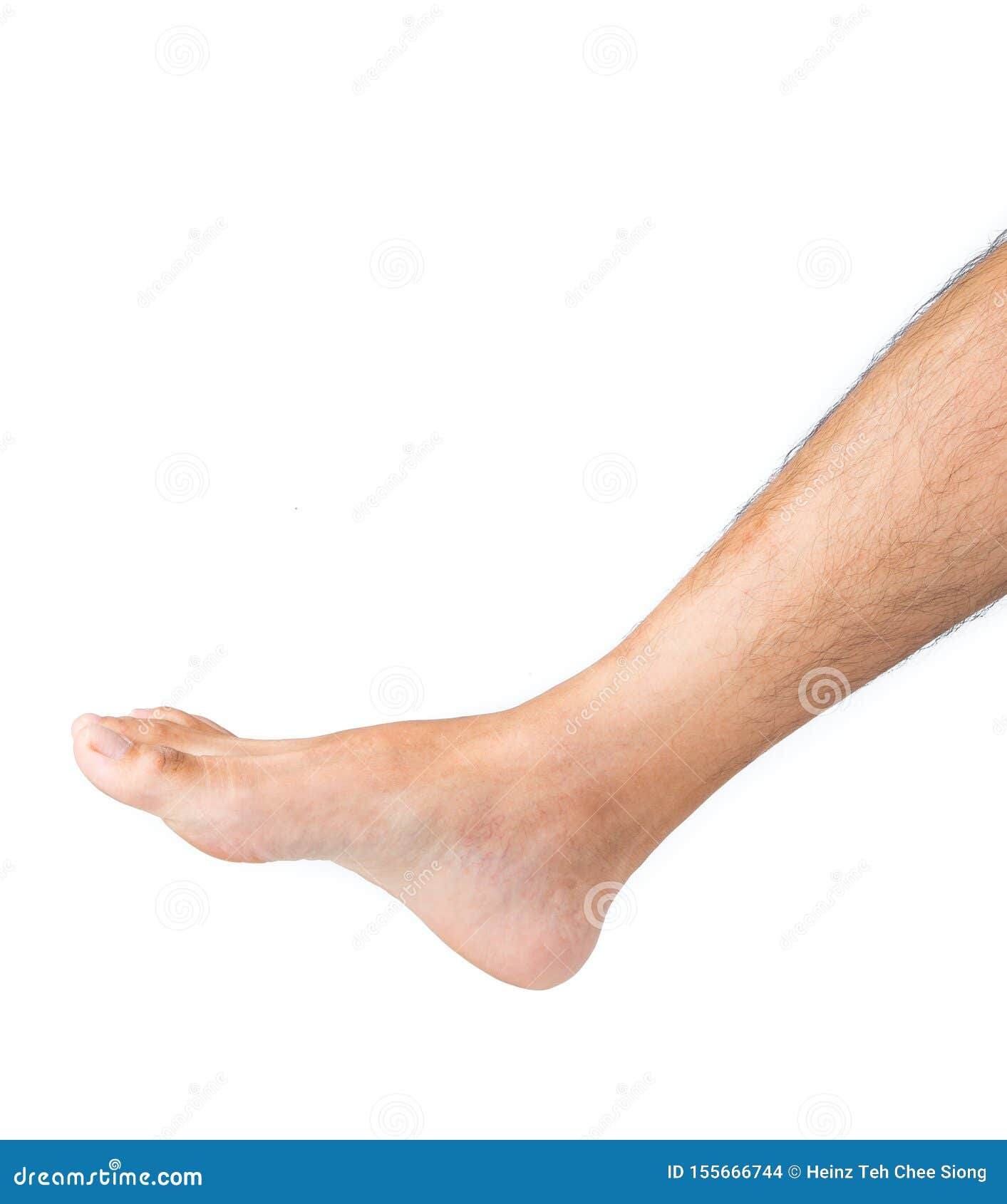 Man leg stock photo. Image of removal, person, joint - 155666744