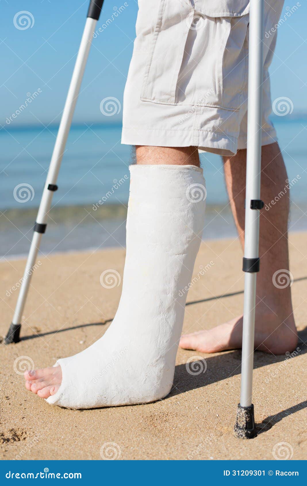 Man with Leg Plaster at a Beach Stock Image - Image of care, crutches ...