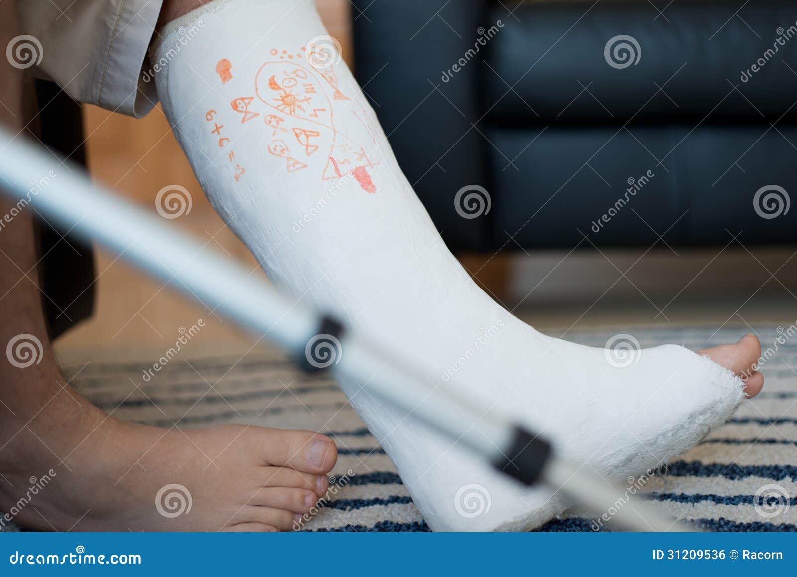 Man with a leg plaster stock photo. Image of cure, closeup - 31209536