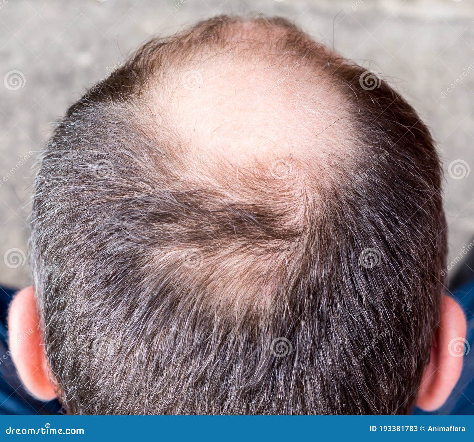 Man with little hair stock image. Image of stubble, lost - 193381783