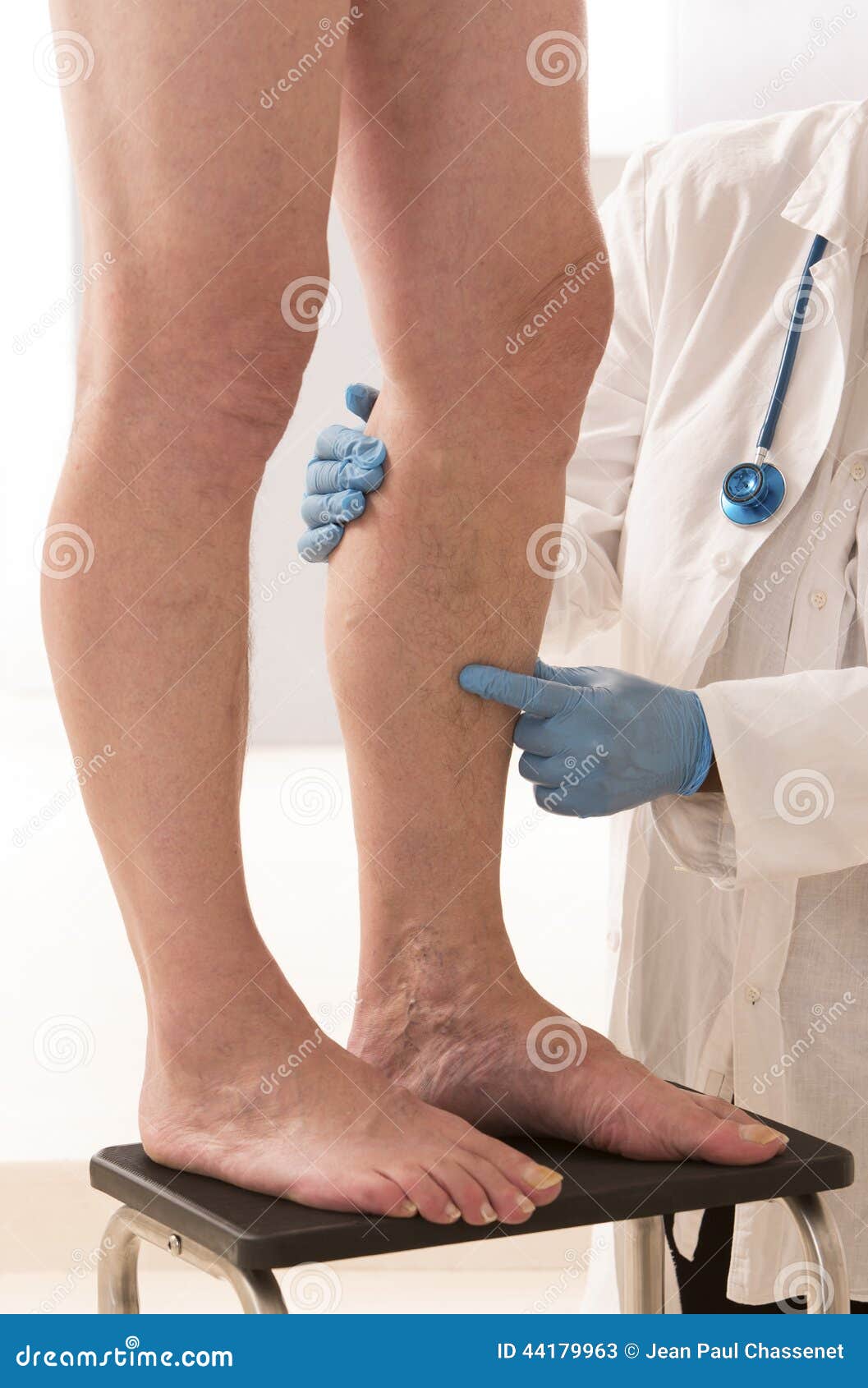 Man Lower Limb Vascular Examination by Phlebologist Stock Image - Image ...