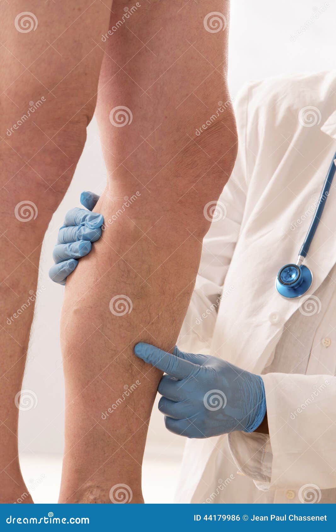 Man Lower Limb Vascular Examination by Phlebologist Stock Photo - Image ...