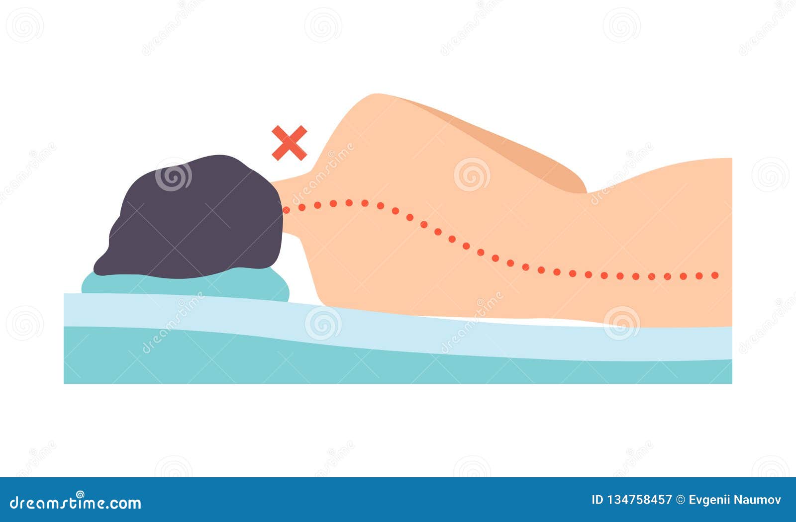 Man Lying On His Side, Seen From Behind, Incorrect Sleeping Posture For ...