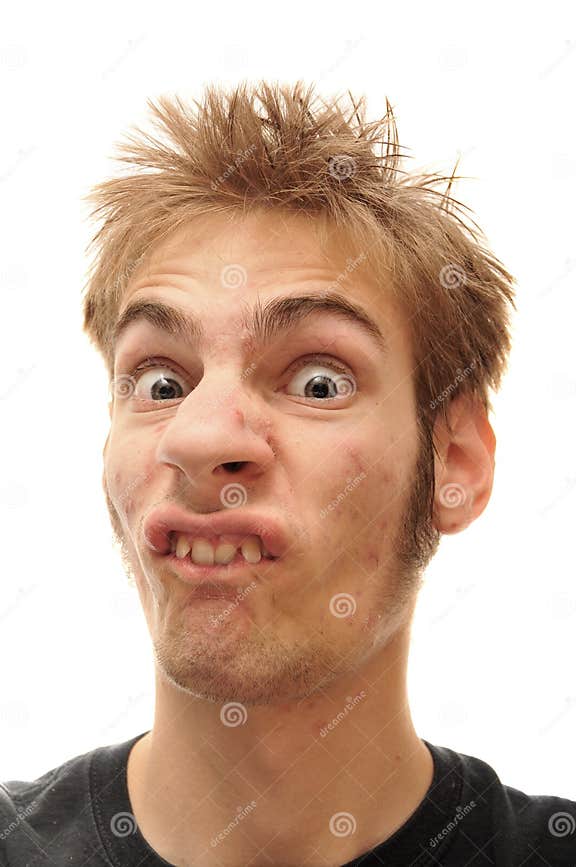 Man Making Strange Face with Crooked Teeth Stock Image - Image of teeth ...