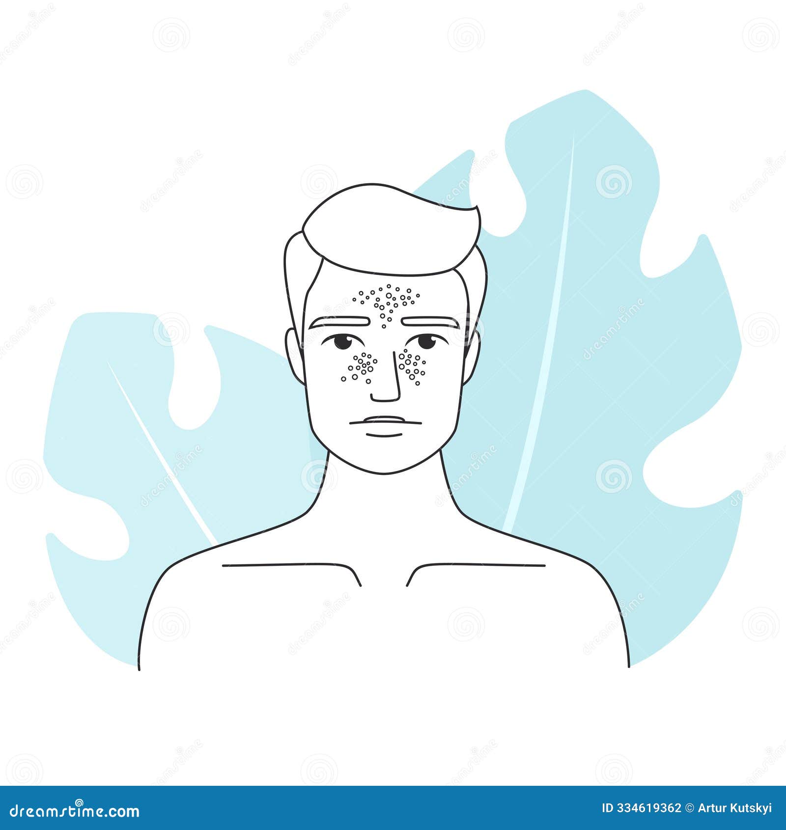 Hyperpigmentation Cartoons, Illustrations & Vector Stock Images - 901 ...