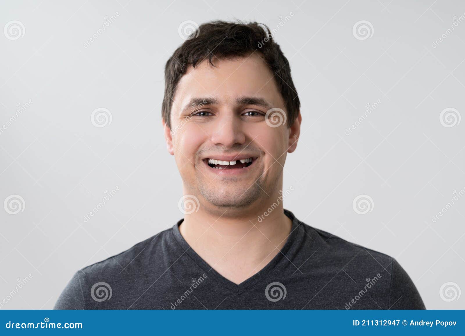 Man with Missing Tooth stock image. Image of absence - 211312947