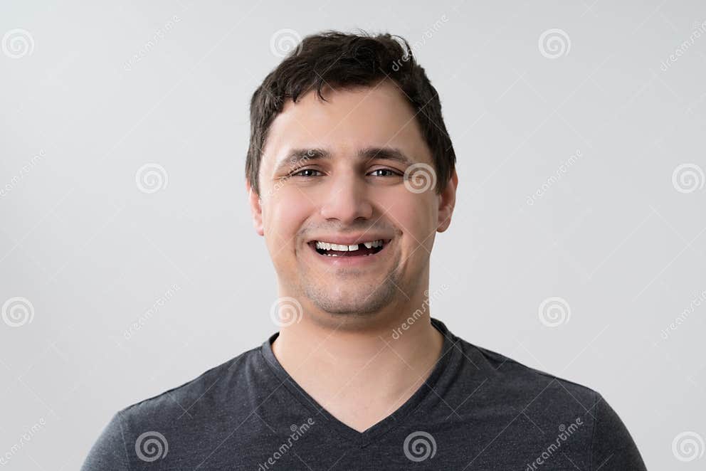 Man with Missing Tooth stock image. Image of absence - 211312947