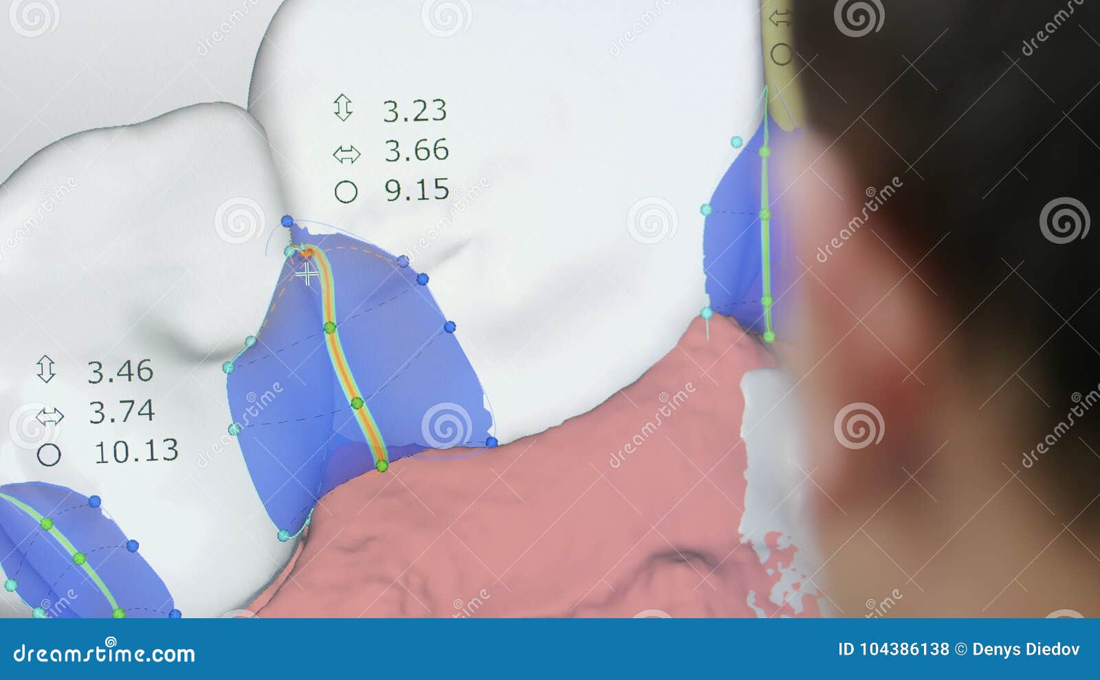 A Man Models a Computer Model of Teeth on a Computer Stock Footage ...