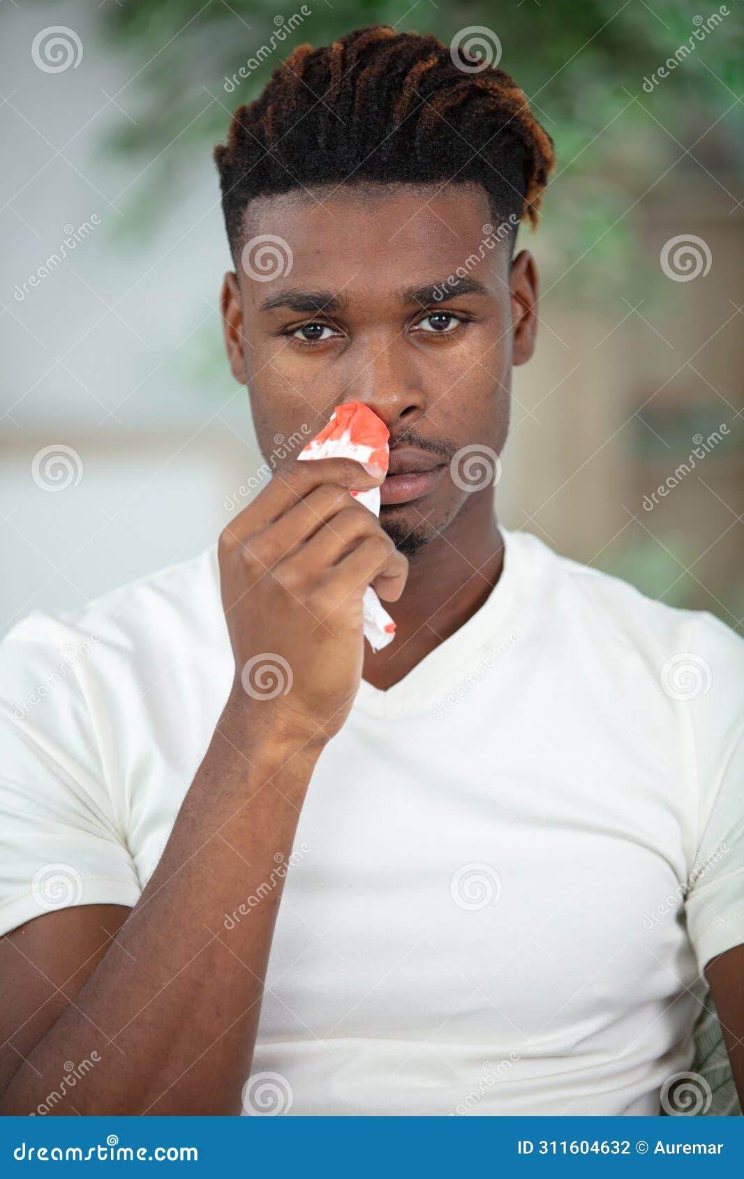 Man with Nose Bleed at Home Stock Photo - Image of nosebleed, illness ...