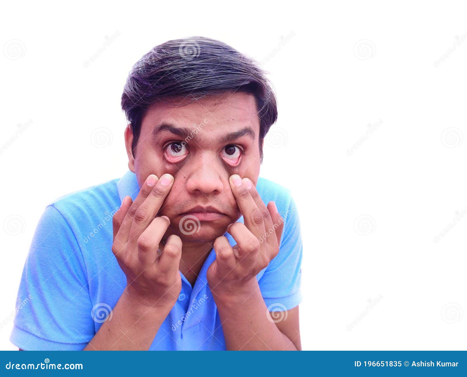 Man Open Eyes by Hand Looking into Camera Stock Image - Image of face ...