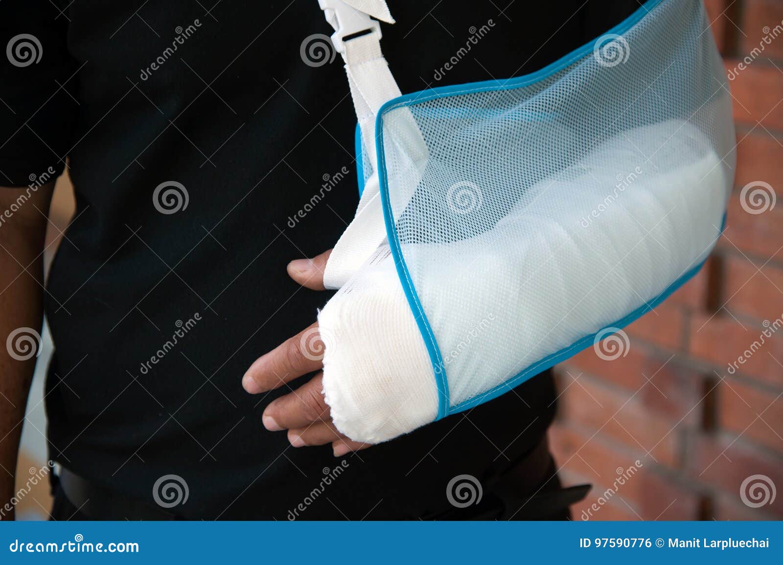 Man with a Plaster because Broken Arm. Stock Photo - Image of hand ...