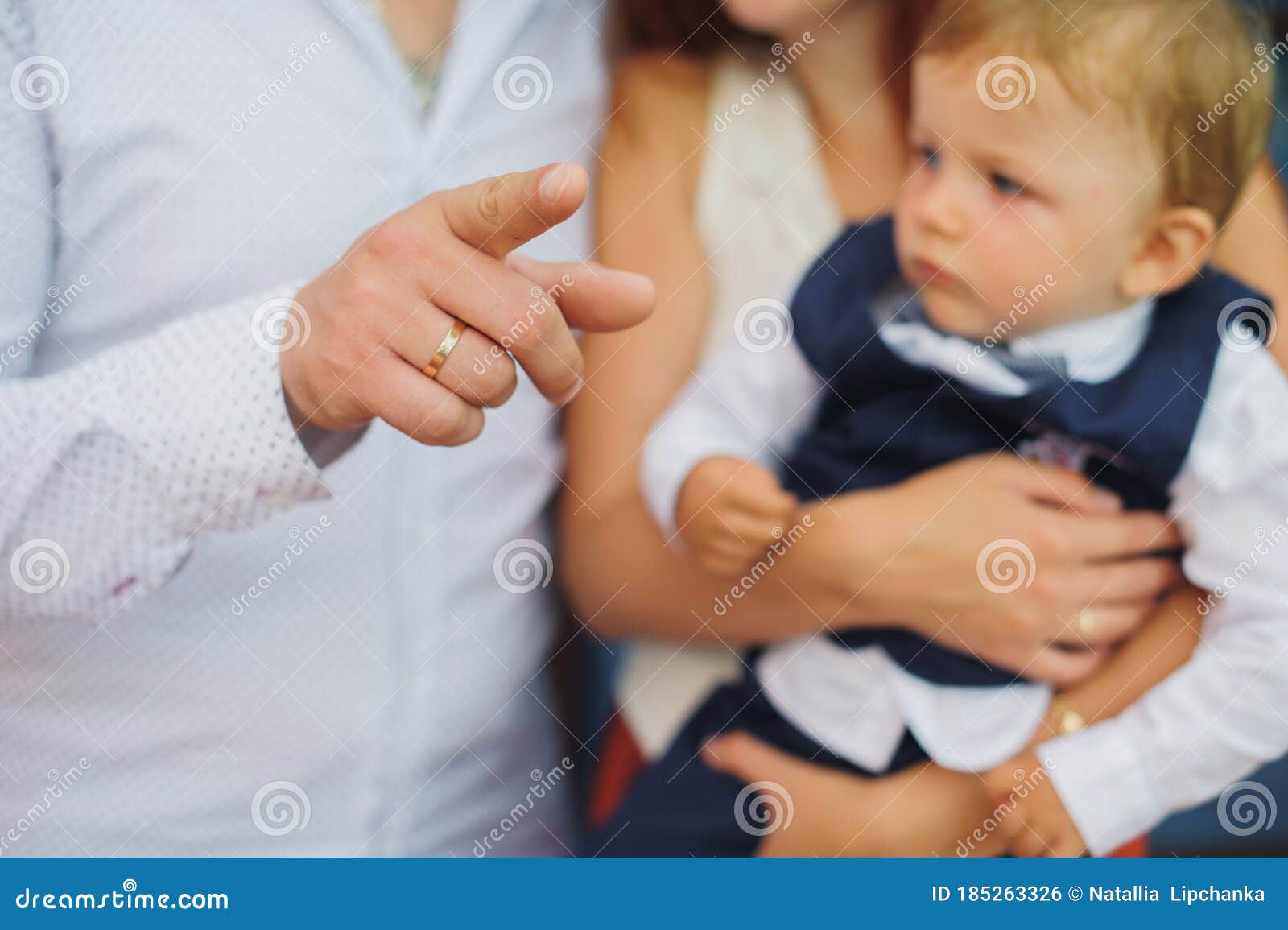 Finger Of A Child`s Hand Is Bent In The Upper First Phalanx Of The ...