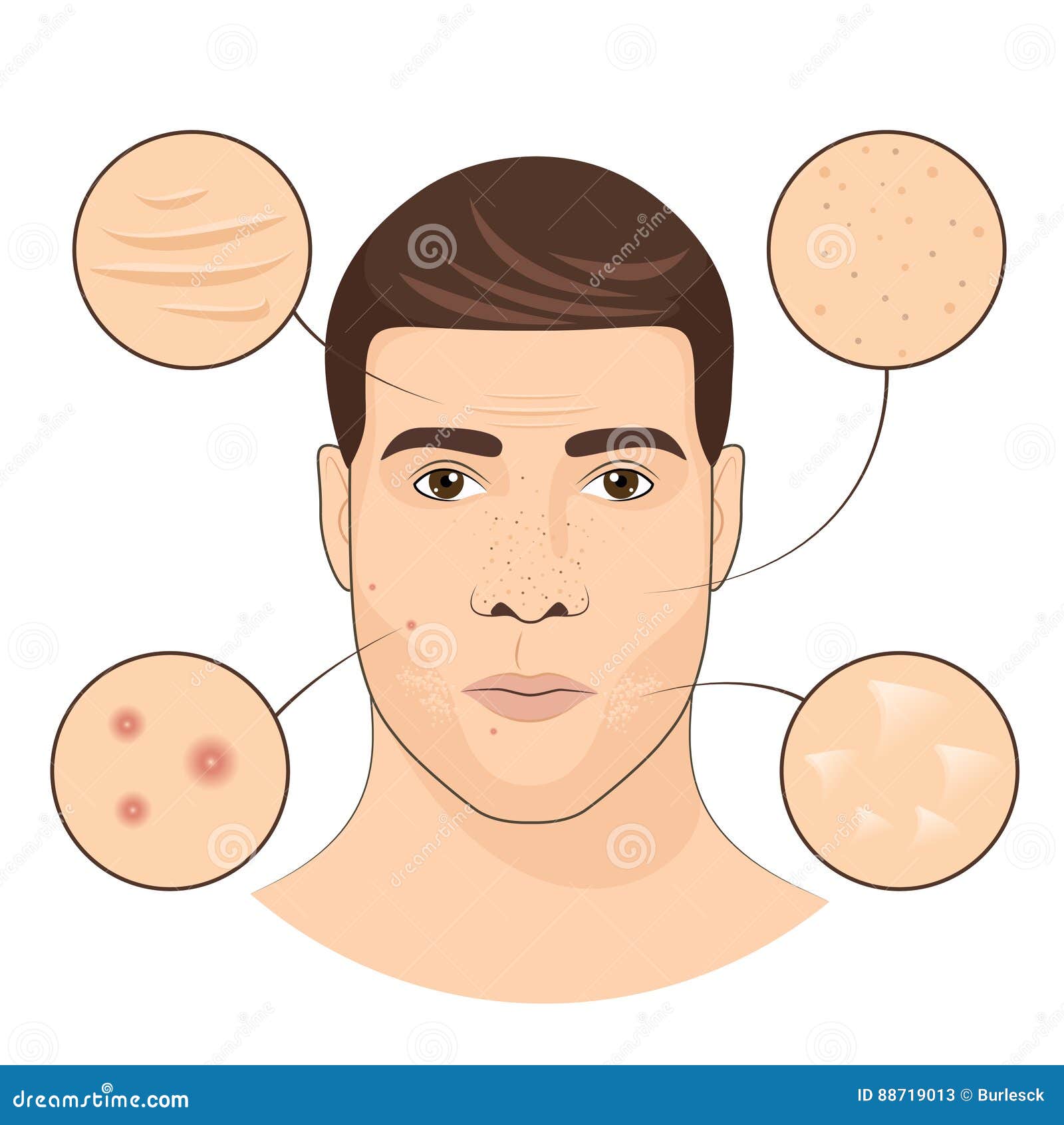 Facial Treatments Icons. Treatment Of Skin Diseases, Sebum Removal And ... Facial Treatments Icons. Treatment Of Skin Diseases, Sebum Removal And ...