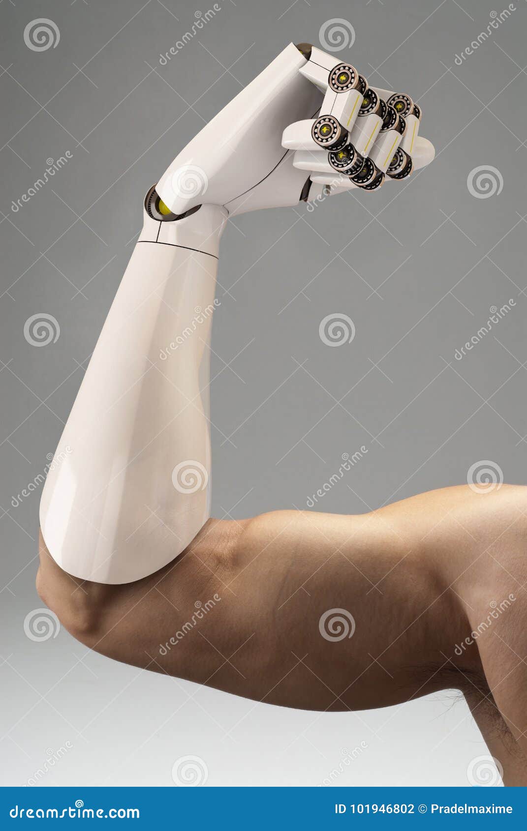 Man With Prosthetic Arm Royalty-Free Stock Image | CartoonDealer.com ...