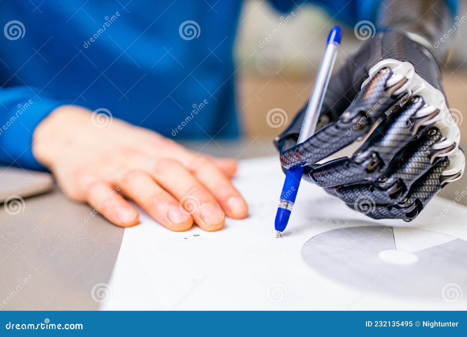 Man with Prosthetic Hand Writing Development at Home Stock Image ...