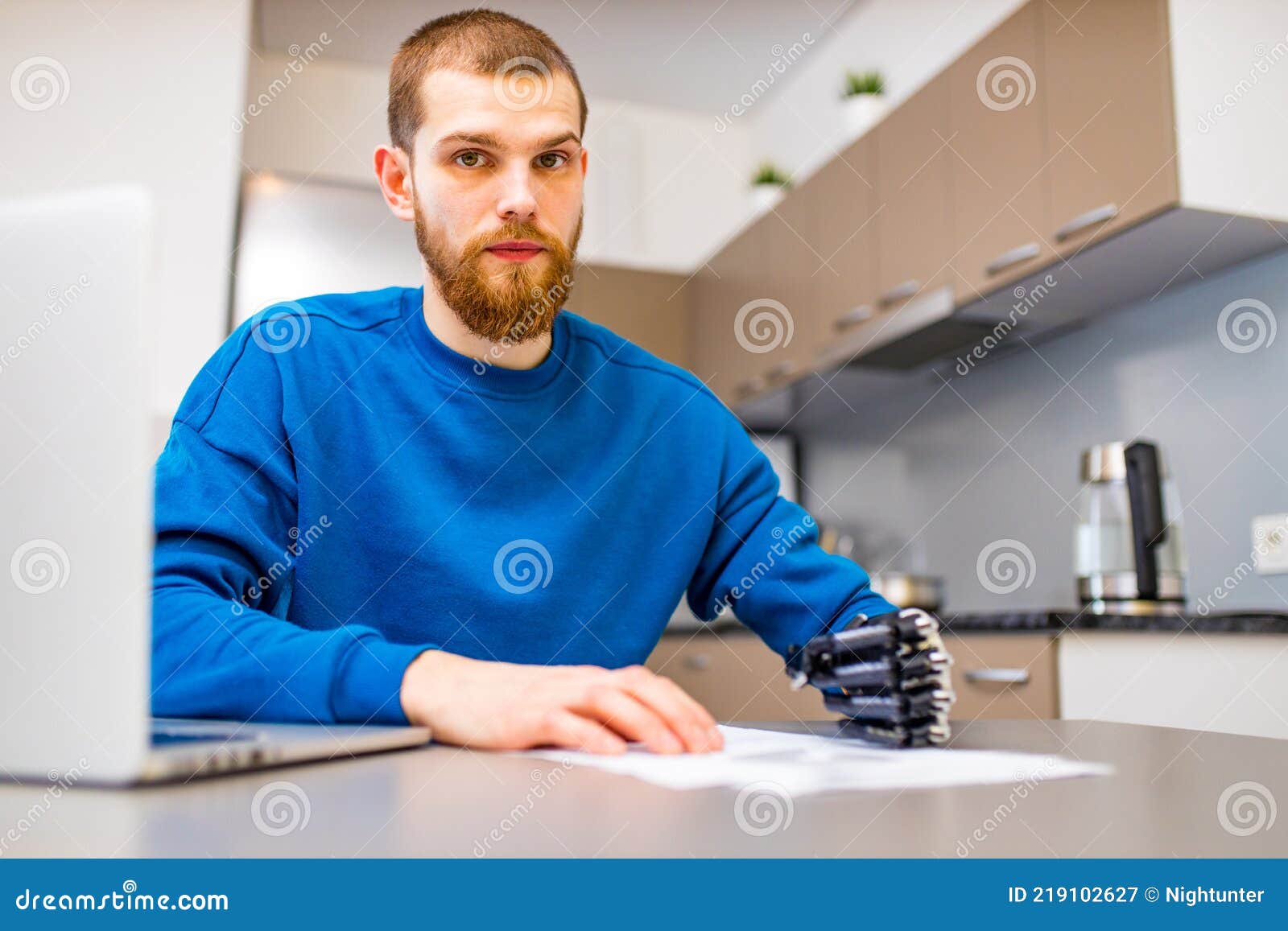 Man with Prosthetic Hand Writing Development at Home Stock Image ...