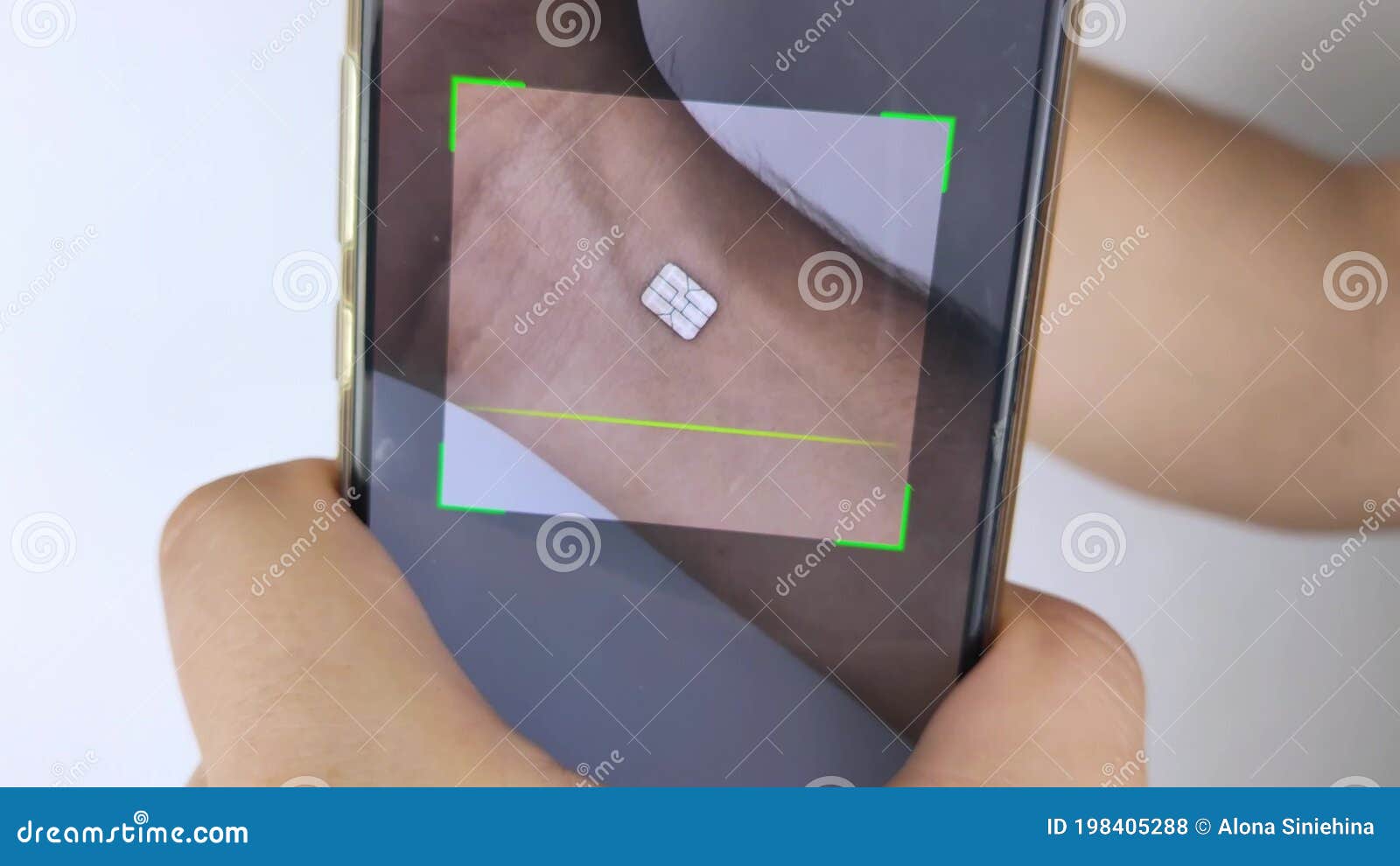 A Man Reads Data Using a Special Device from an Implanted Chip in a Man ...