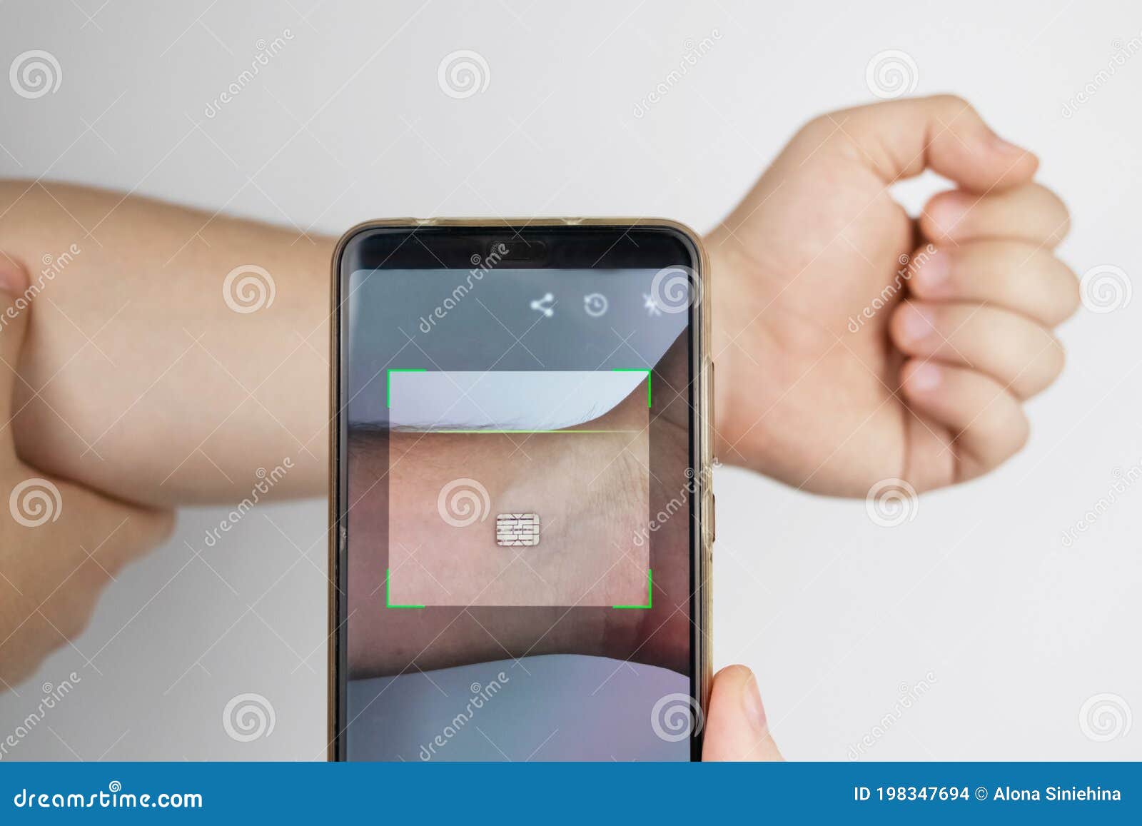 Human Chipping Concept, RFID Tags. A Male Hand With An Implantable Chip ...