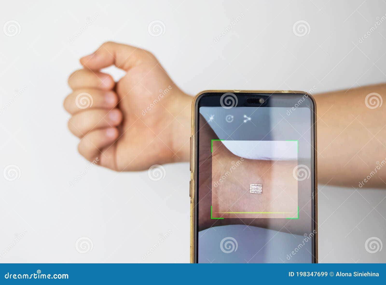 Human Chipping Concept, RFID Tags. A Male Hand With An Implantable Chip ...