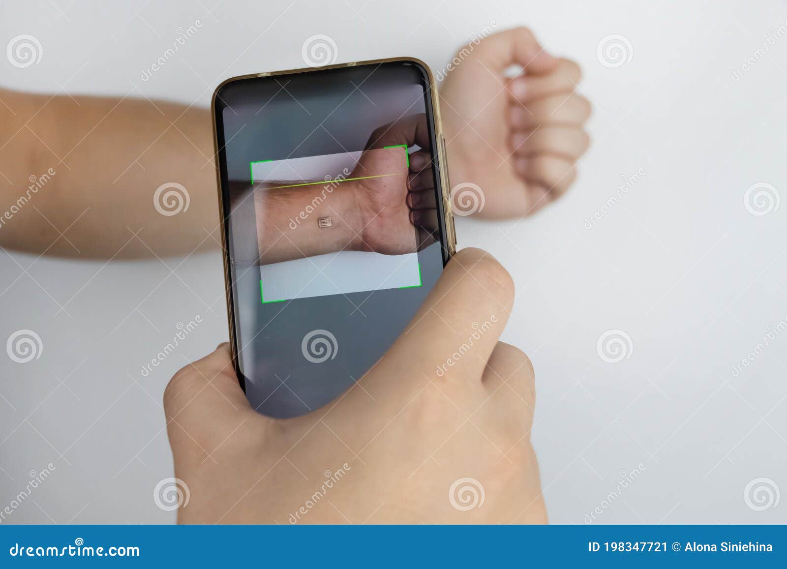Human Chipping Concept, RFID Tags. A Male Hand With An Implantable Chip ...
