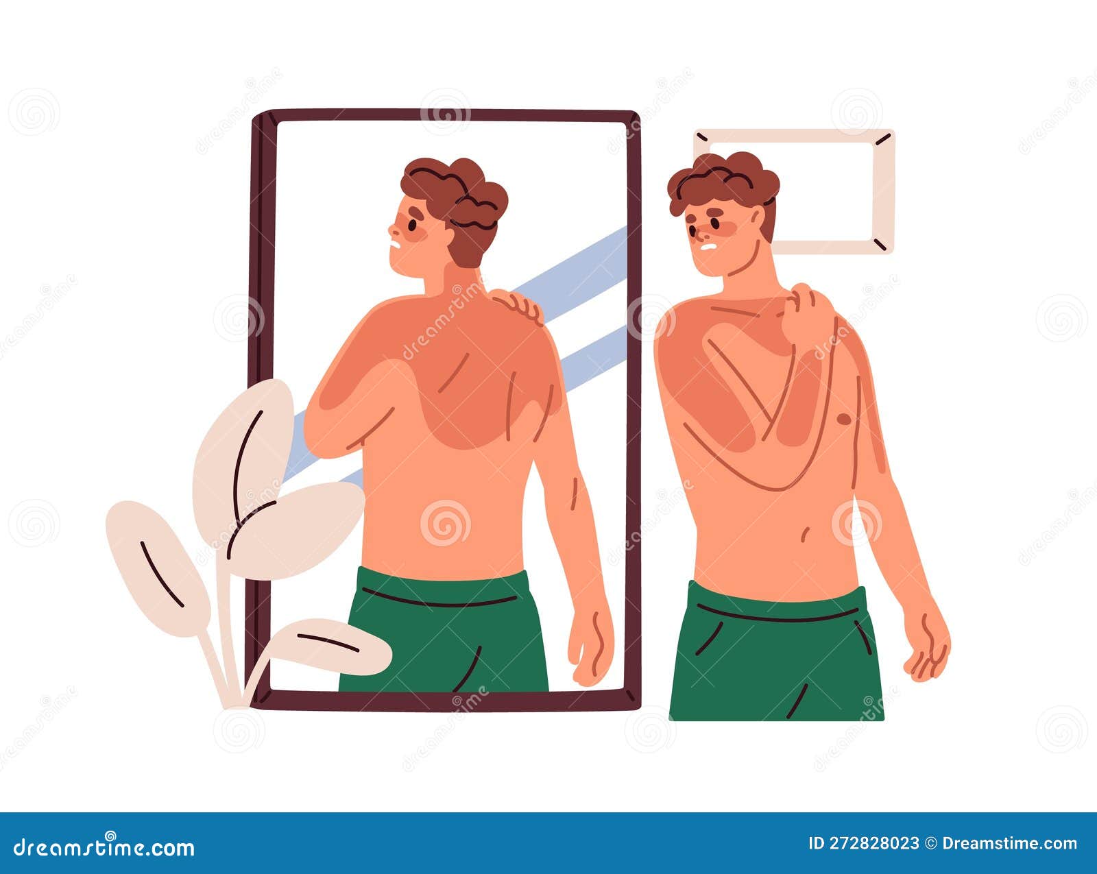 Man With Skin Sunburns Funny Summer Burns On Body After Sunbath Sun