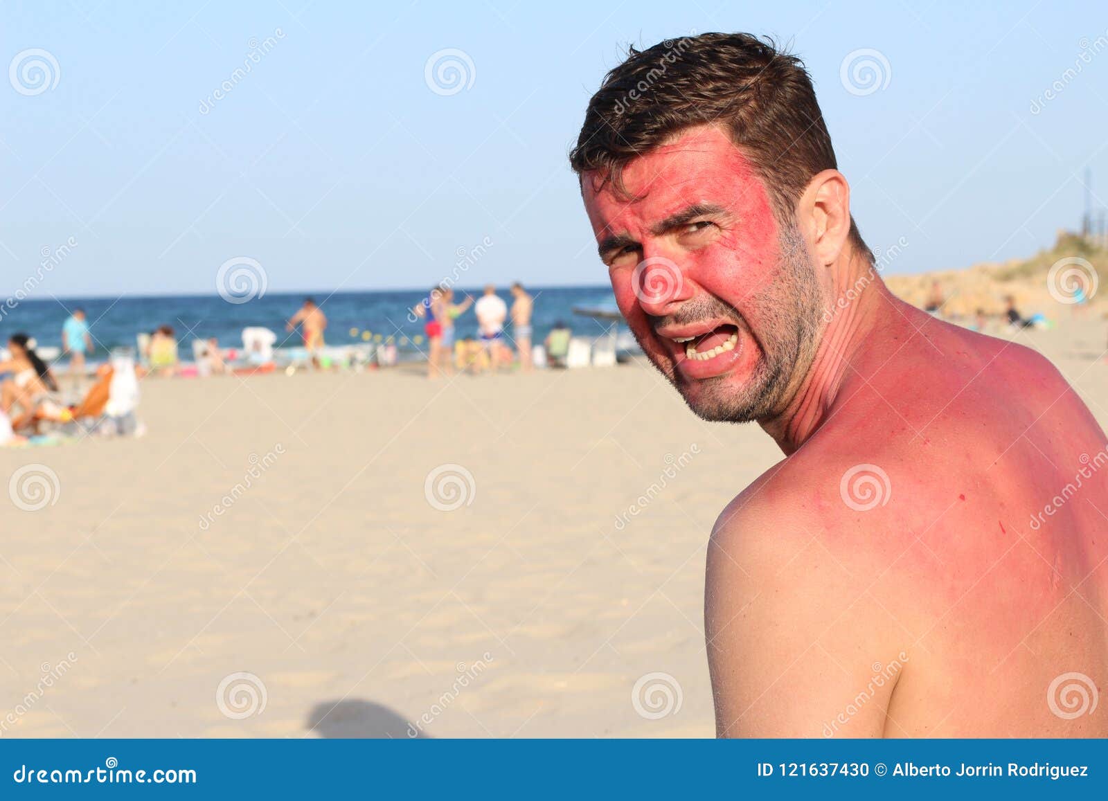 Man with Redness Crying at the Beach Stock Photo - Image of immature ...