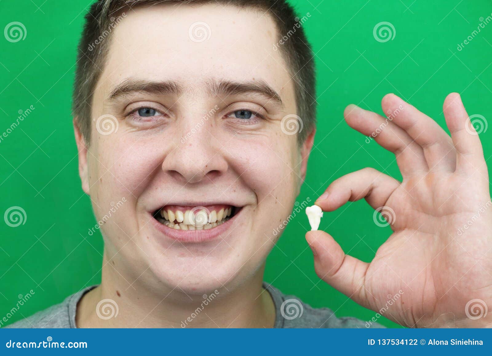A Man after Removing a Wisdom Tooth. the Operation To Remove the Eighth ...