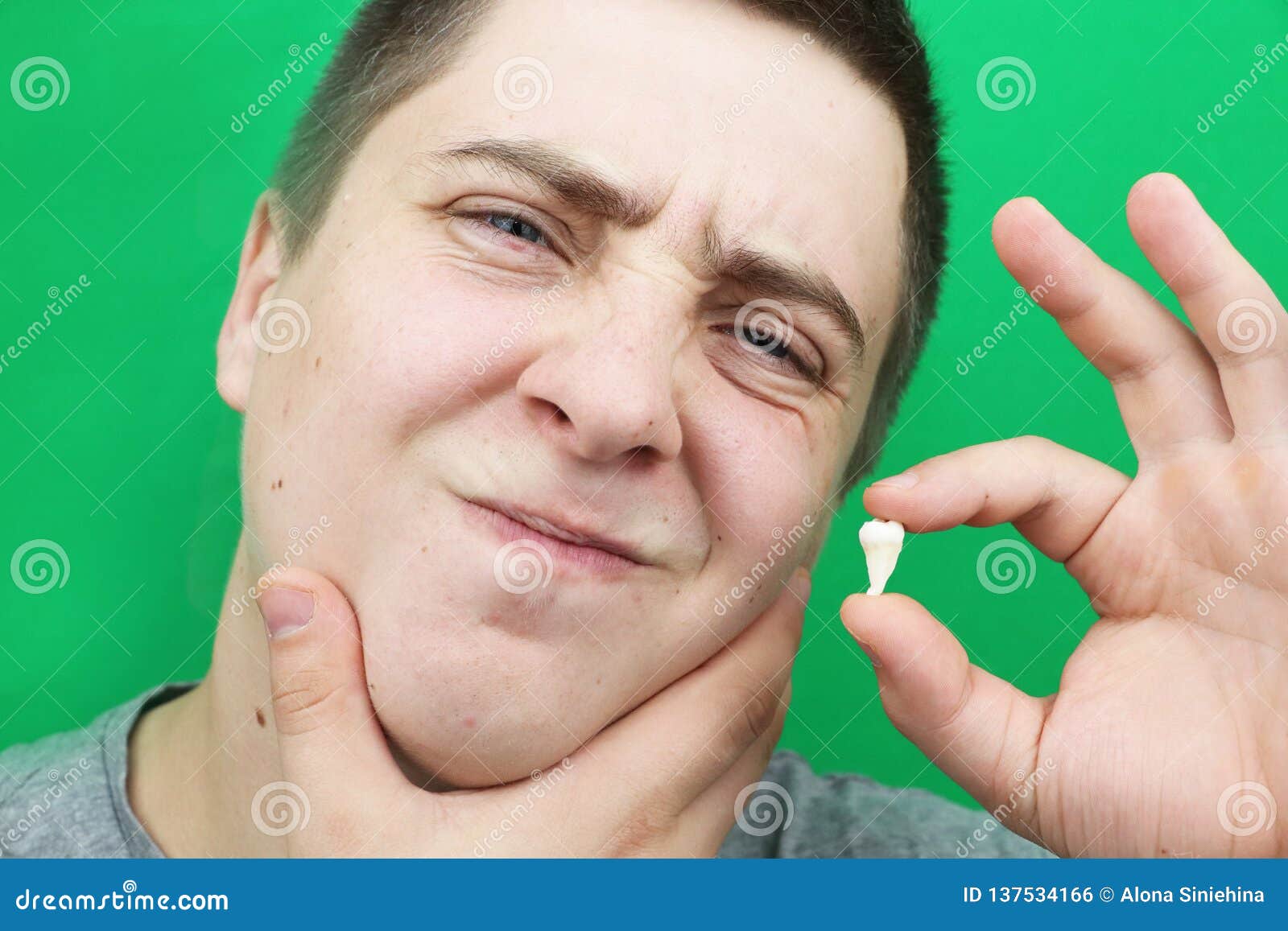 A Man after Removing a Wisdom Tooth. the Operation To Remove the Eighth ...