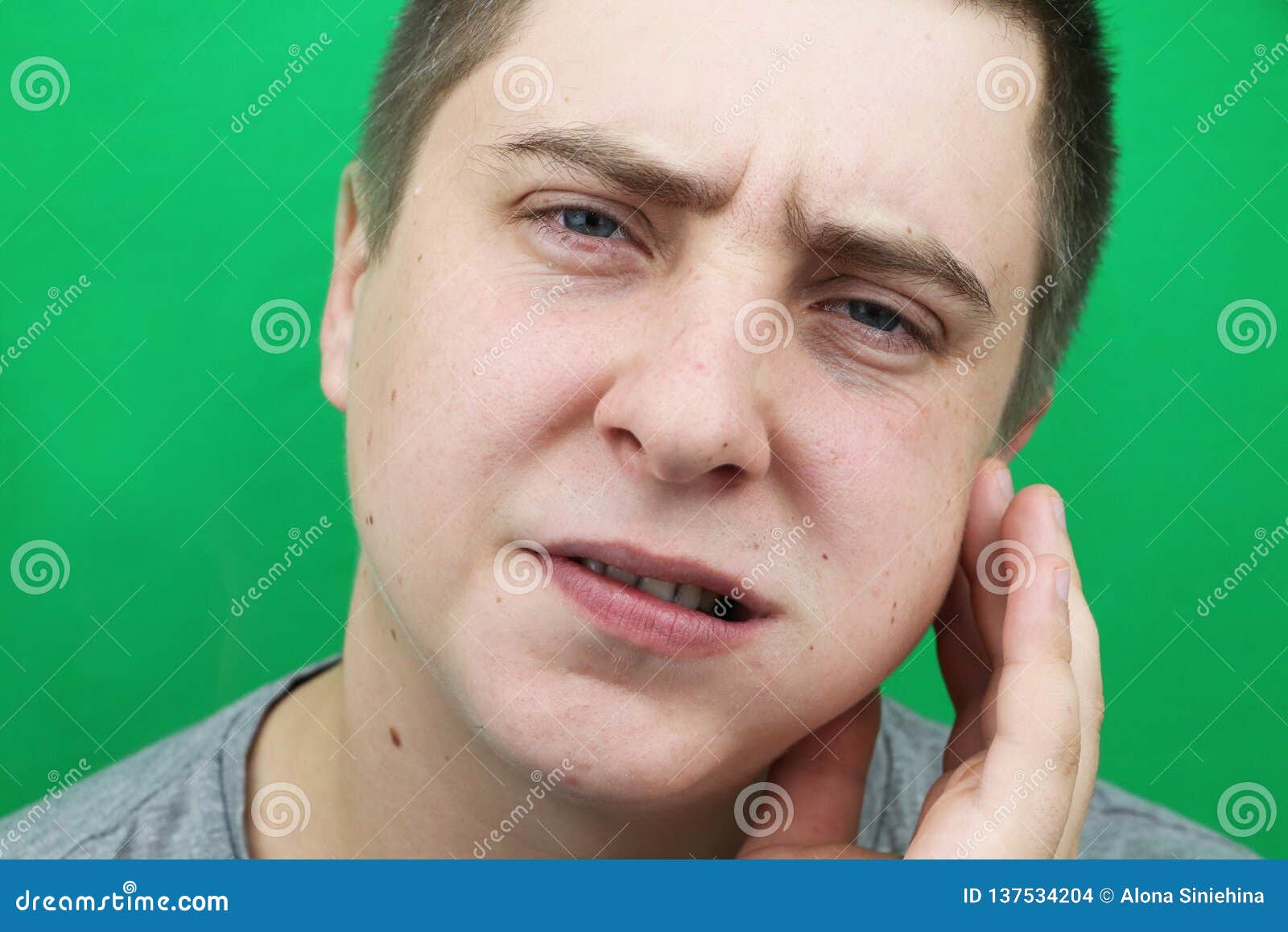 A Man After Removing A Wisdom Tooth. The Operation To Remove The Eighth ...