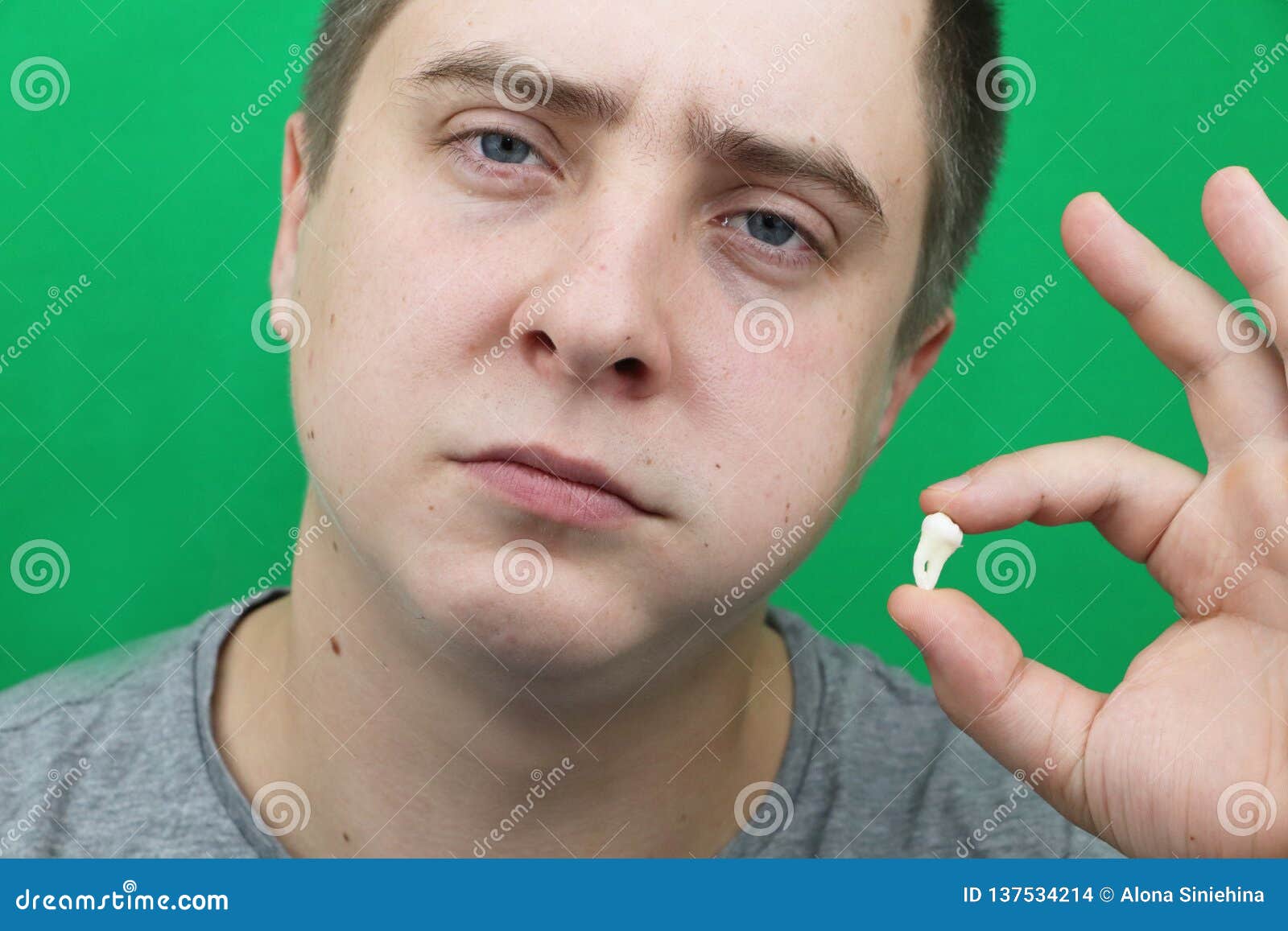 A Man After Removing A Wisdom Tooth. The Operation To Remove The Eighth ...