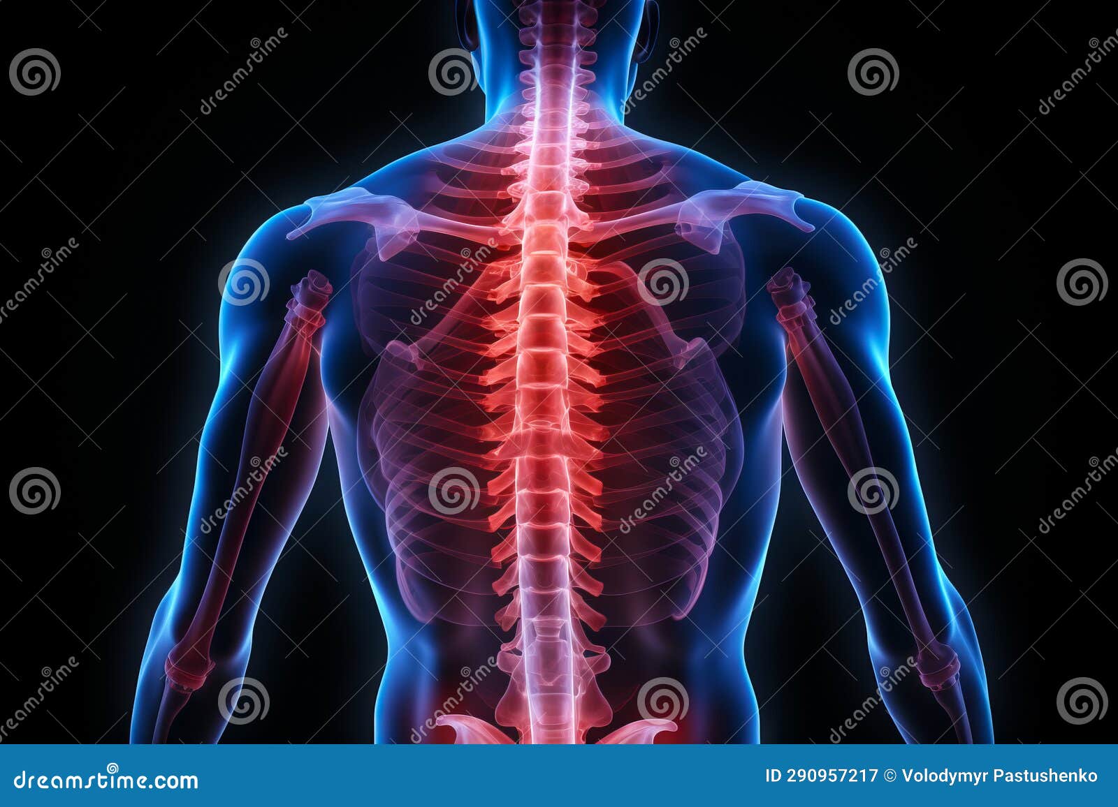 Man S Back with Highlighted Skeleton and Muscles Highlighted ...