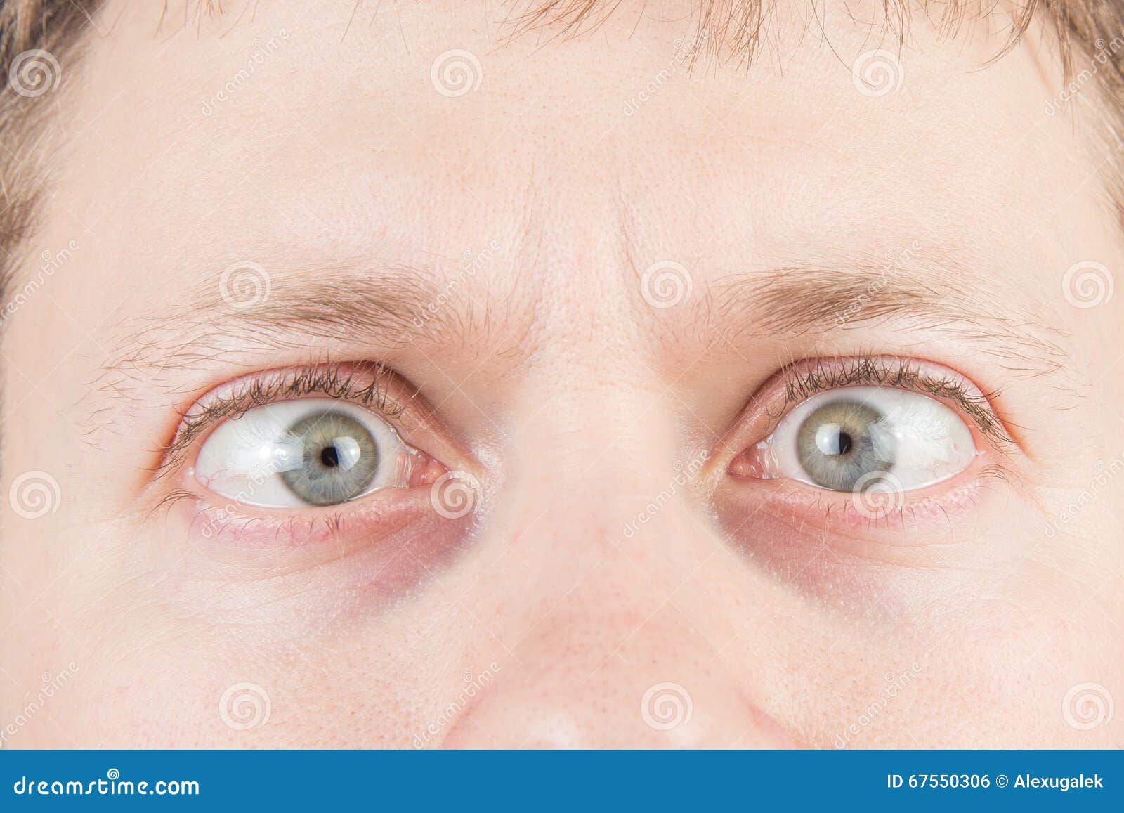 Man s crazy eyes stock photo. Image of insane, patient - 67550306